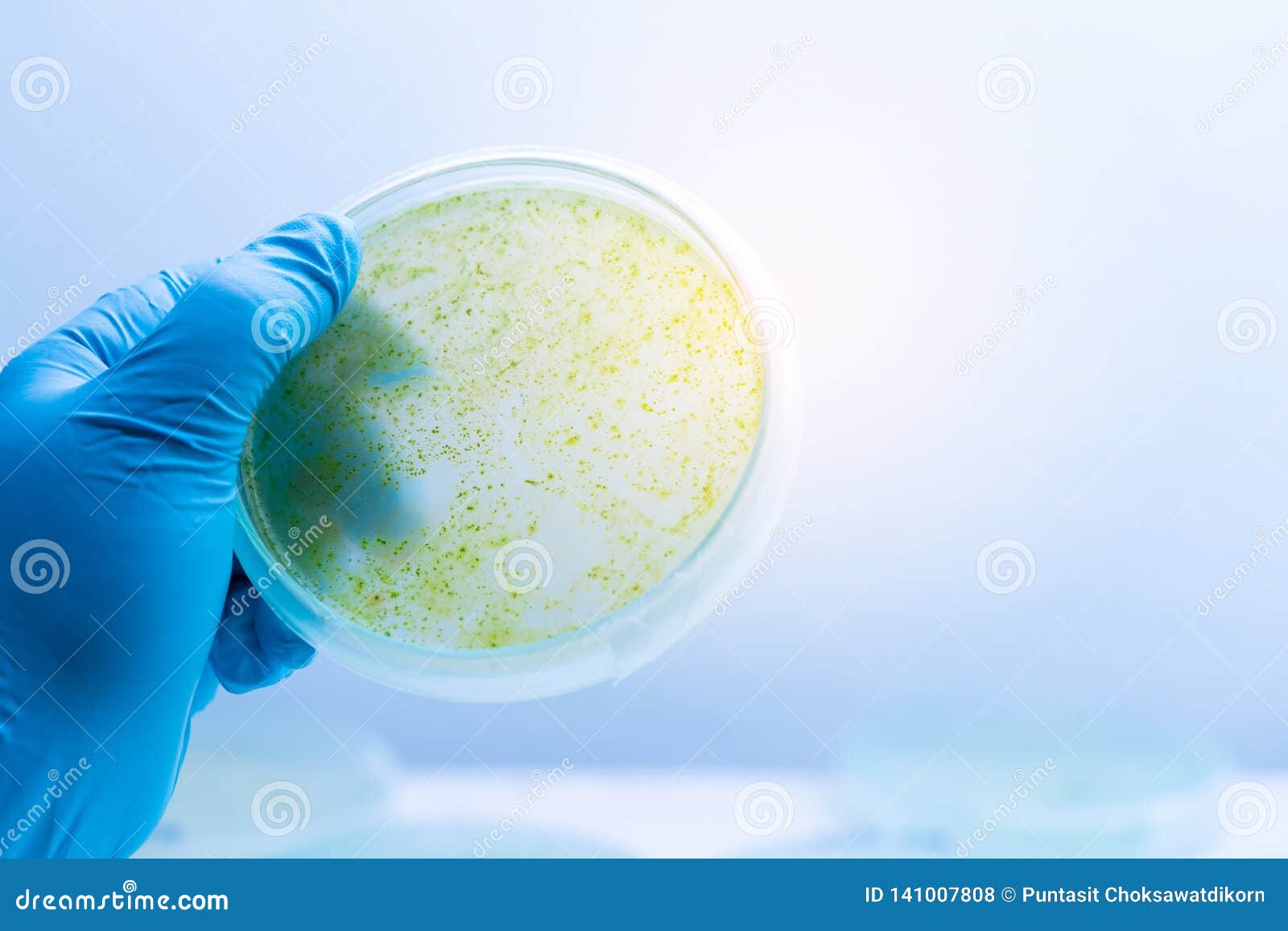 Colony of Blue Green Algae in Culture Medium Plate Stock Photo - Image ...