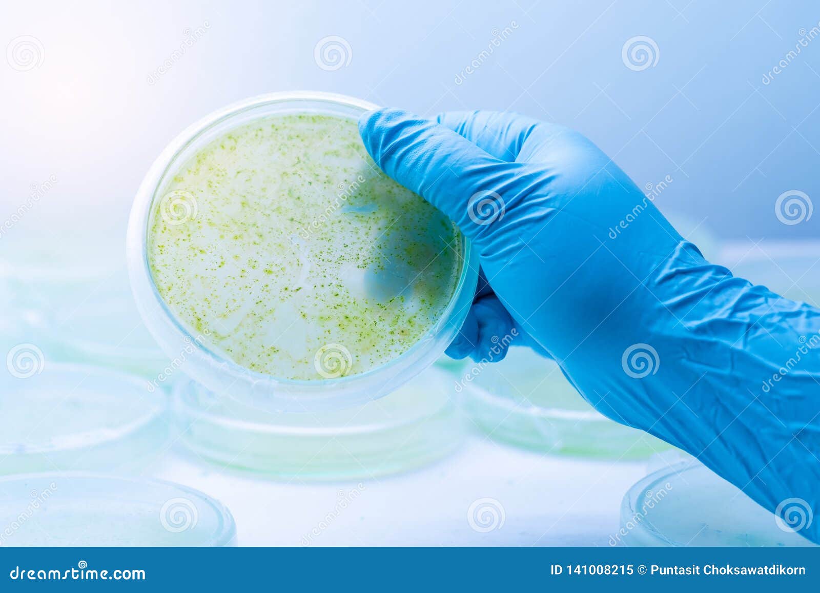 Colony of Blue Green Algae in Culture Medium Plate Stock Image - Image ...