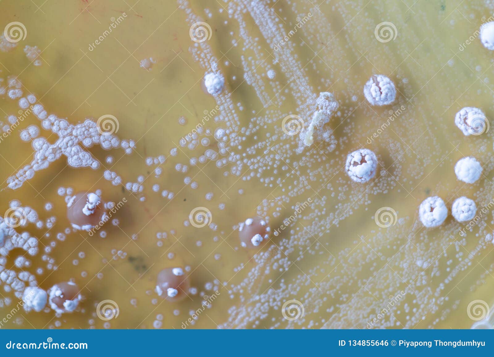 Colony Characteristic of Actinomyces, Bacteria, Yeast and Mold on ...