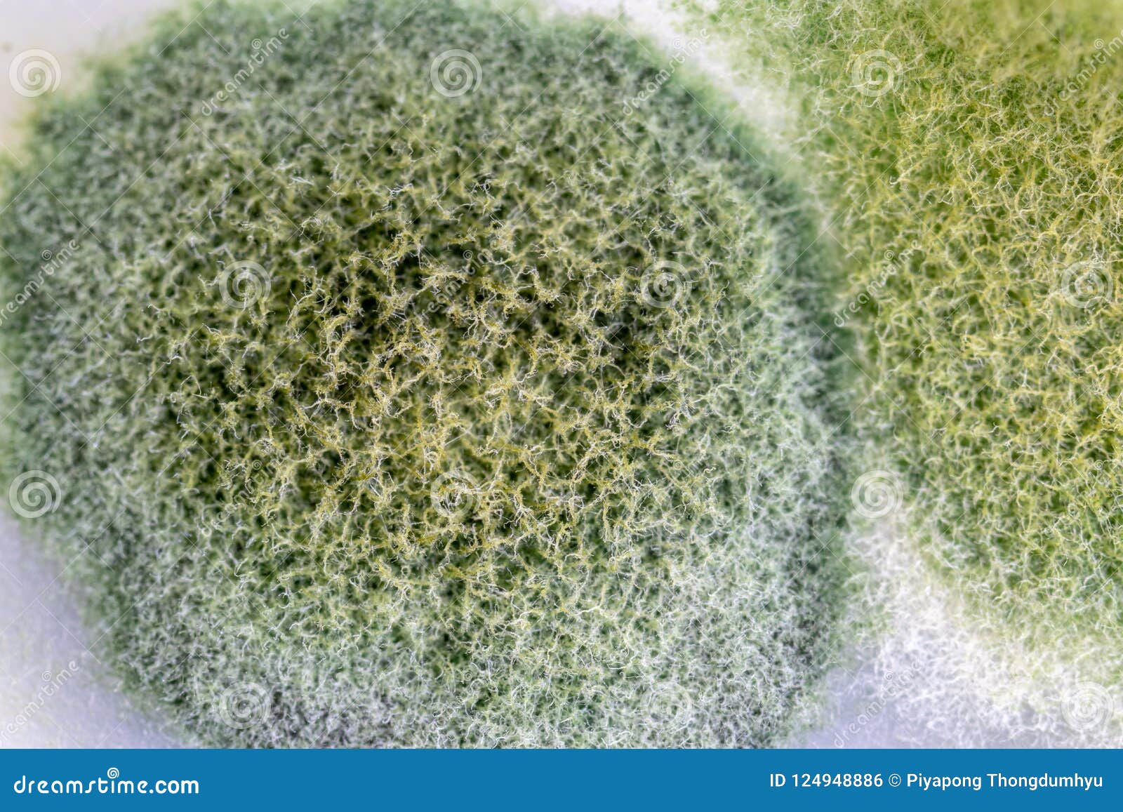 Colony Characteristics of Fungus and Algae in Petri Dish for Education ...