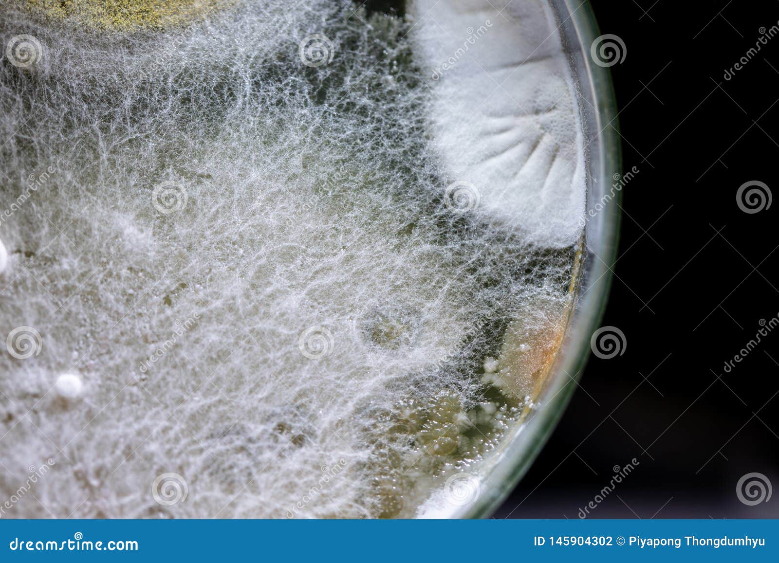 Colony Characteristics of Mold Under the Microscope. Stock Photo ...