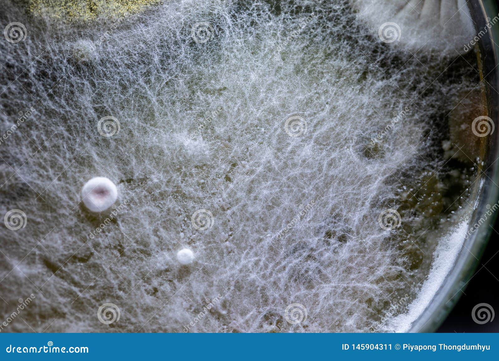 Colony Characteristics of Mold Under the Microscope. Stock Image ...