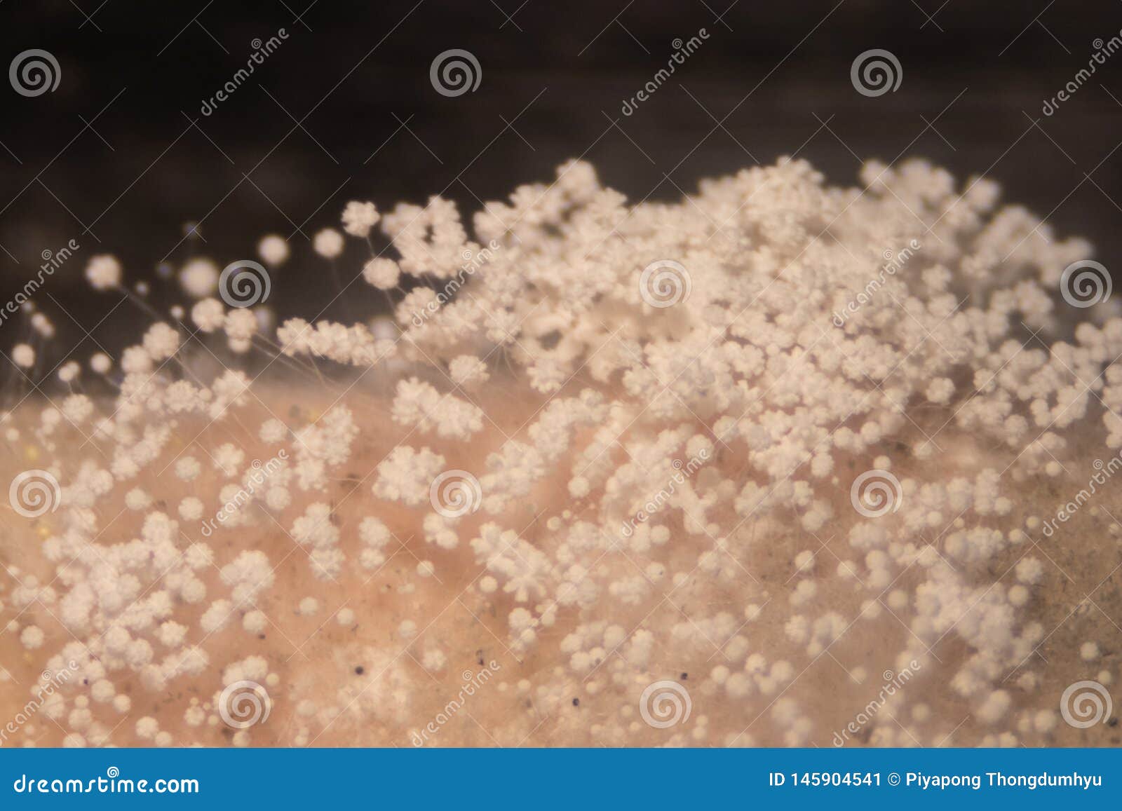 Colony Characteristics of Mold Under the Microscope. Stock Image ...