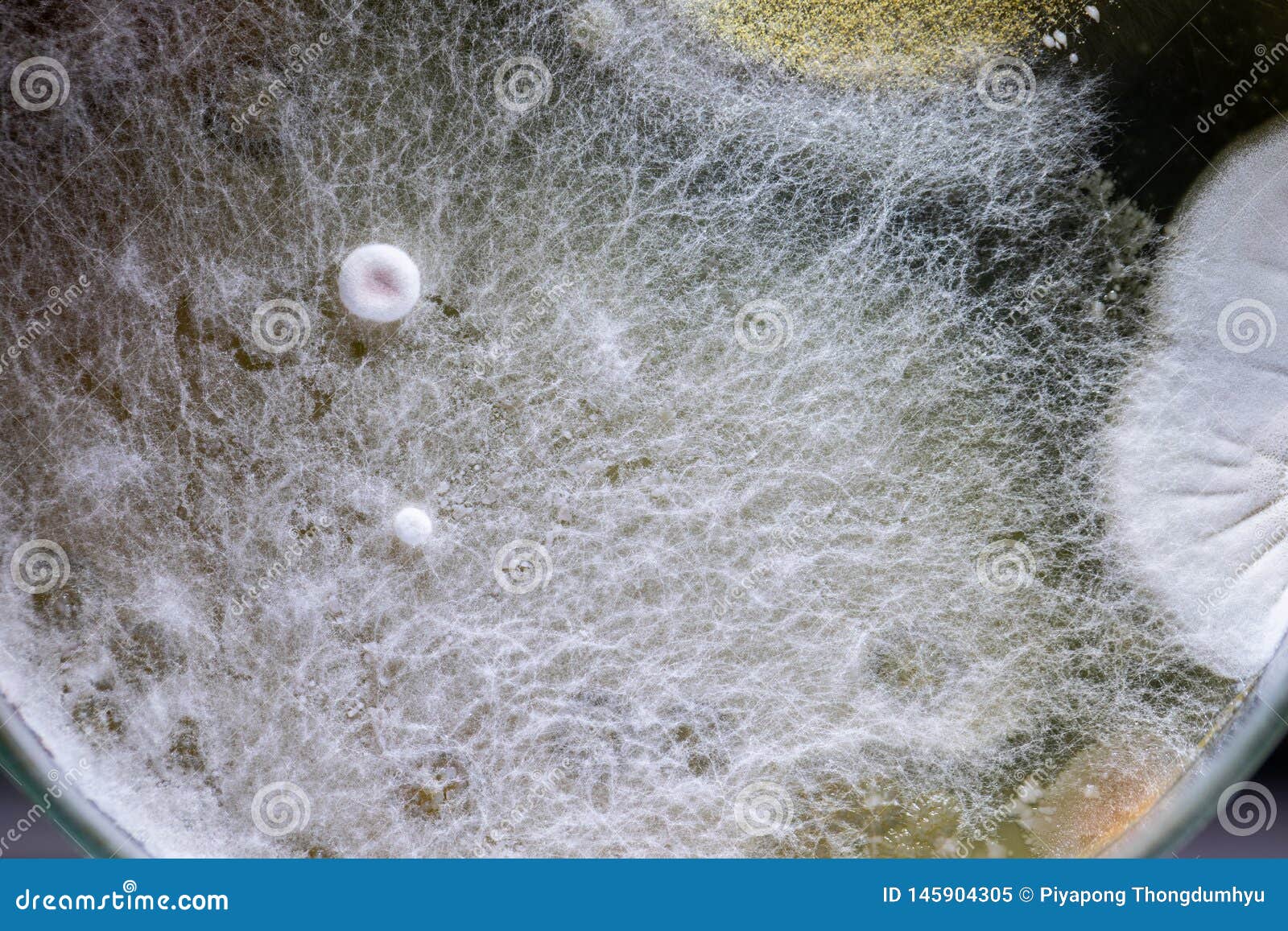 Colony Characteristics of Mold Under the Microscope. Stock Image ...