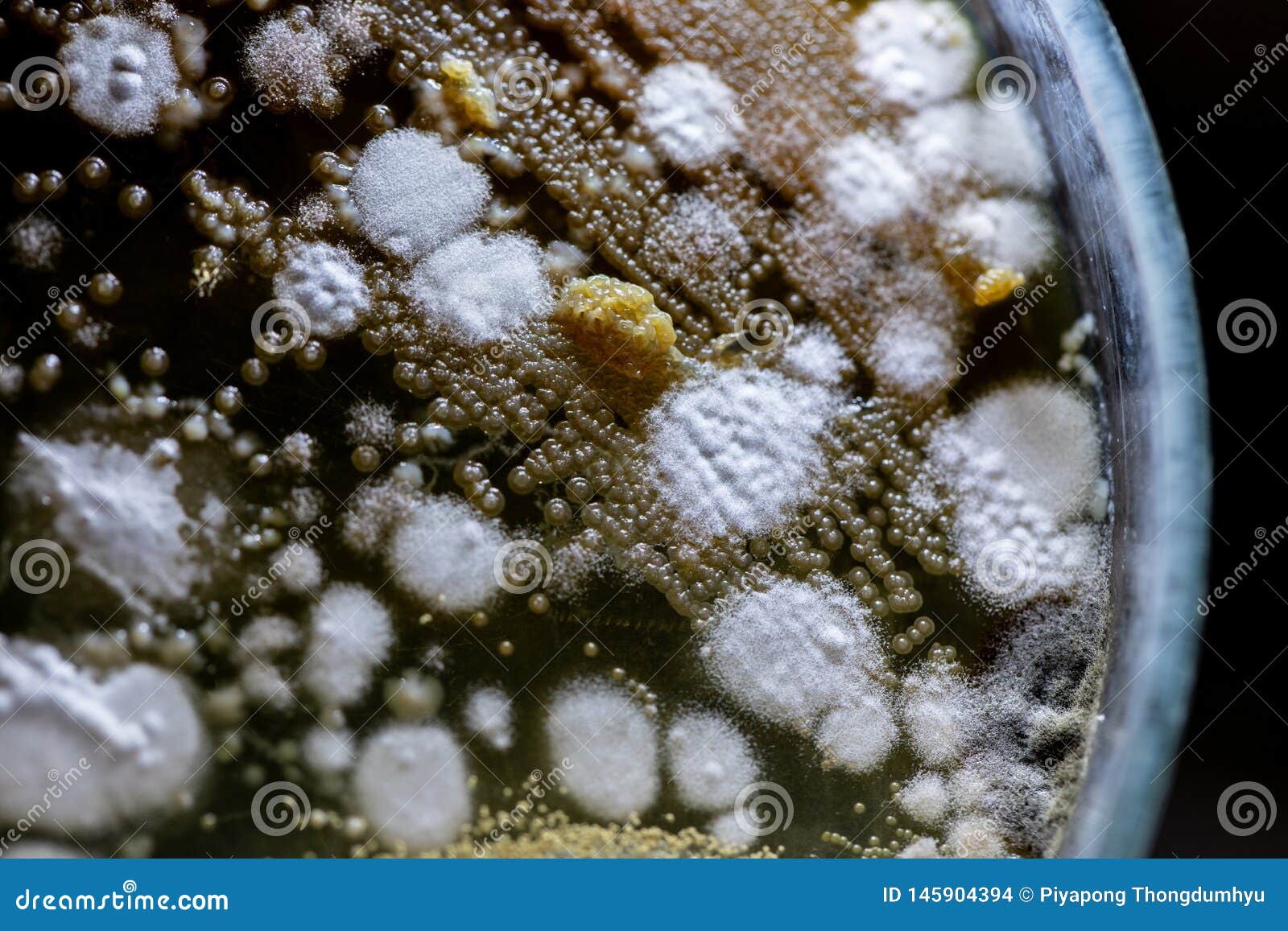 Colony Characteristics of Mold Under the Microscope. Stock Photo ...