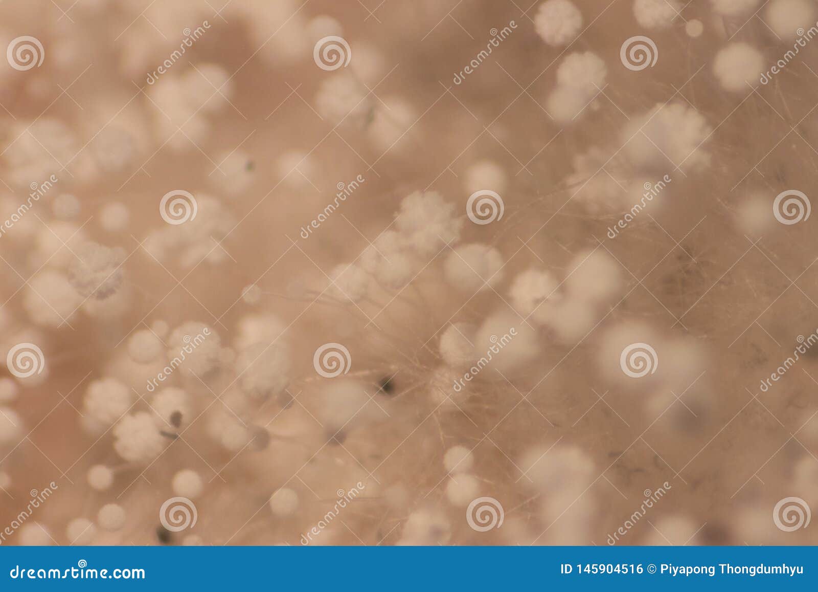 Colony Characteristics of Mold Under the Microscope. Stock Photo ...