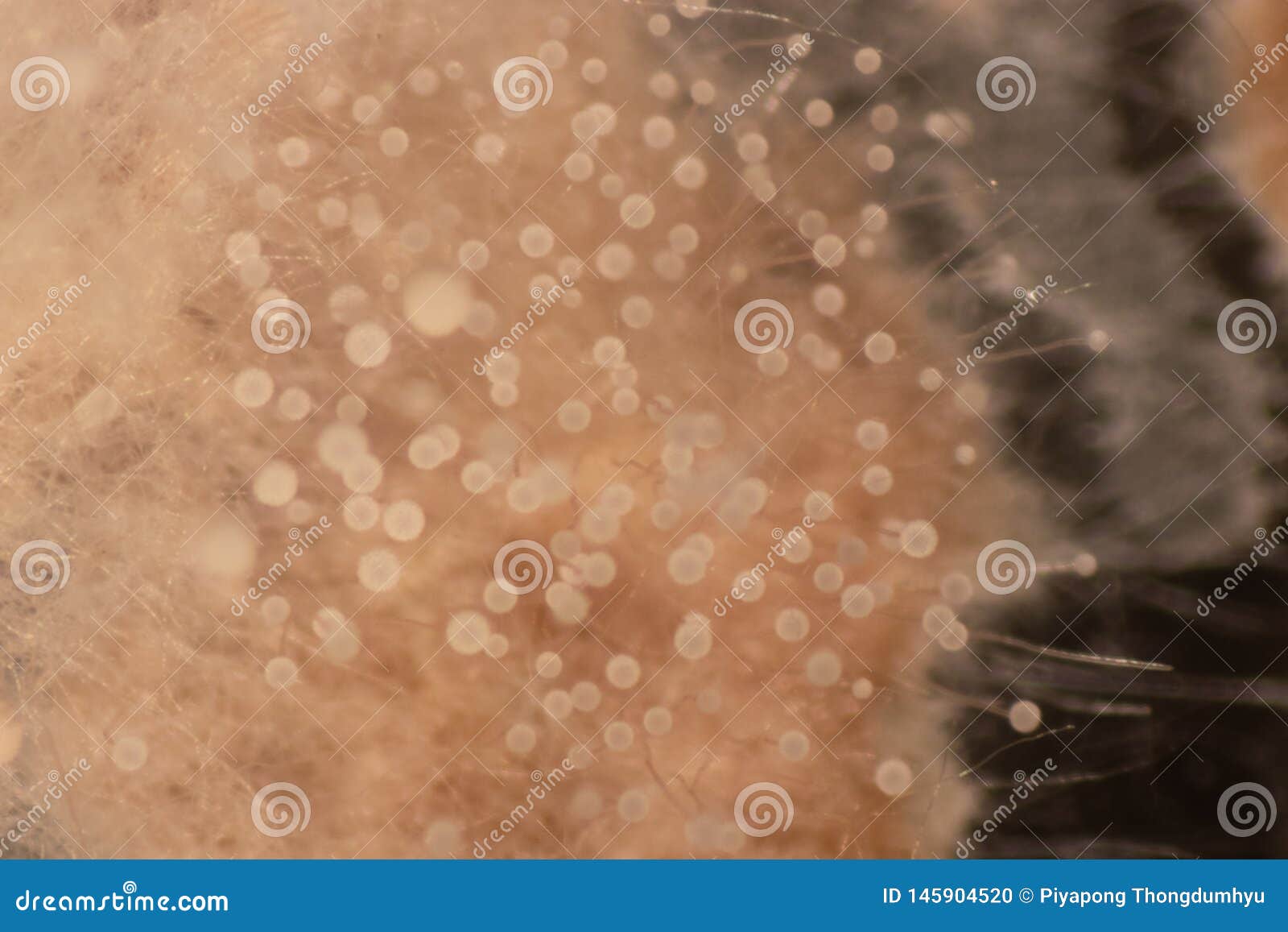 Colony Characteristics of Mold Under the Microscope. Stock Photo ...