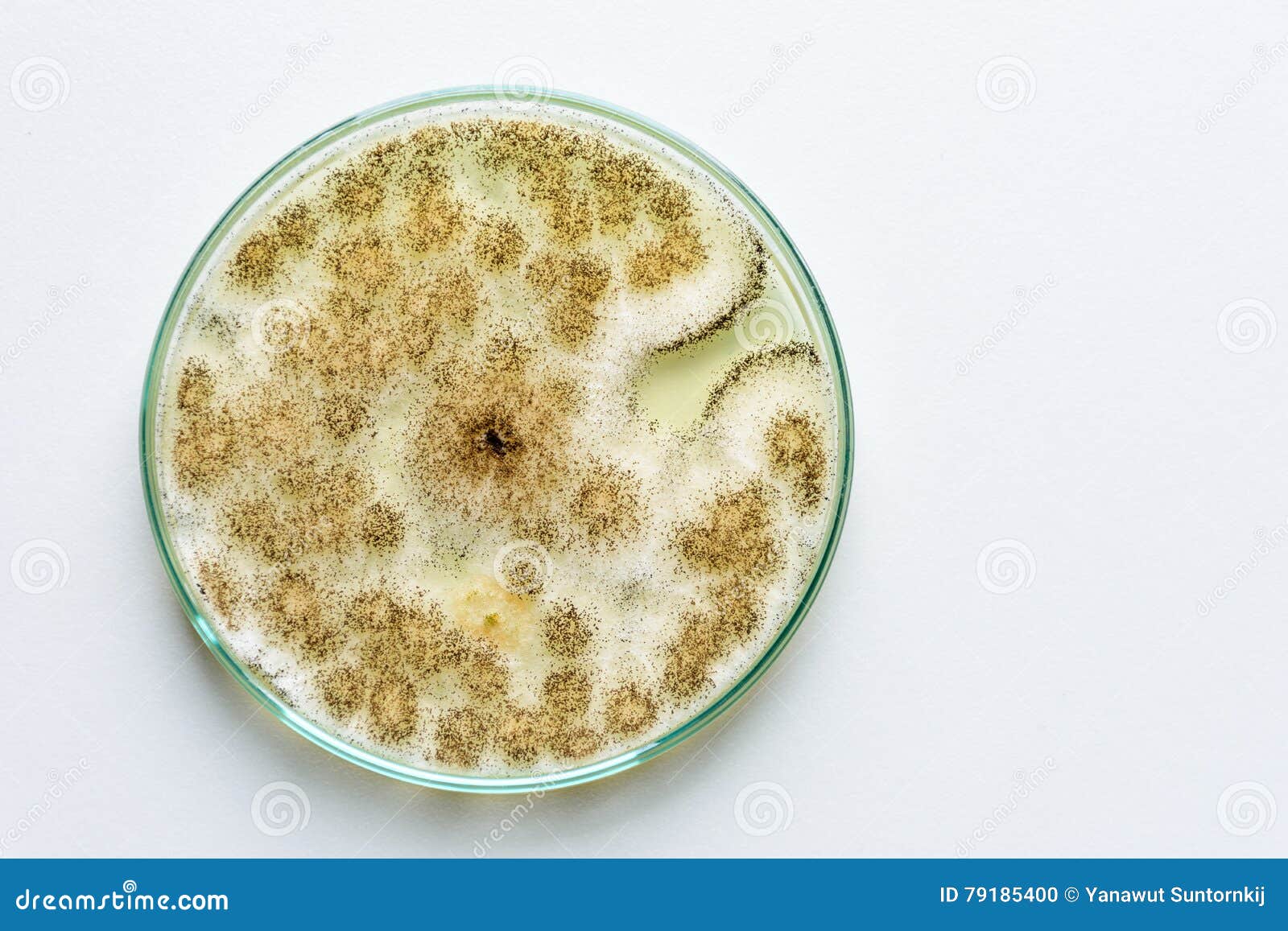 Aspergillus Niger Fungus And Bacteria Growing On Sabouraud Dextrose ...