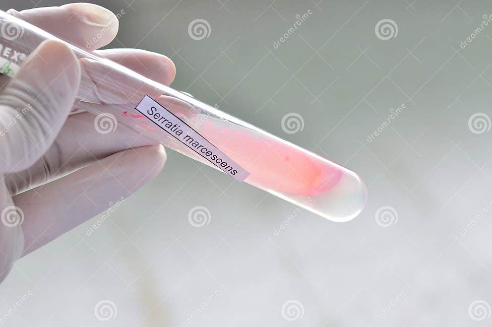 Colony in slant agar stock image. Image of grow, bacterial - 43355133