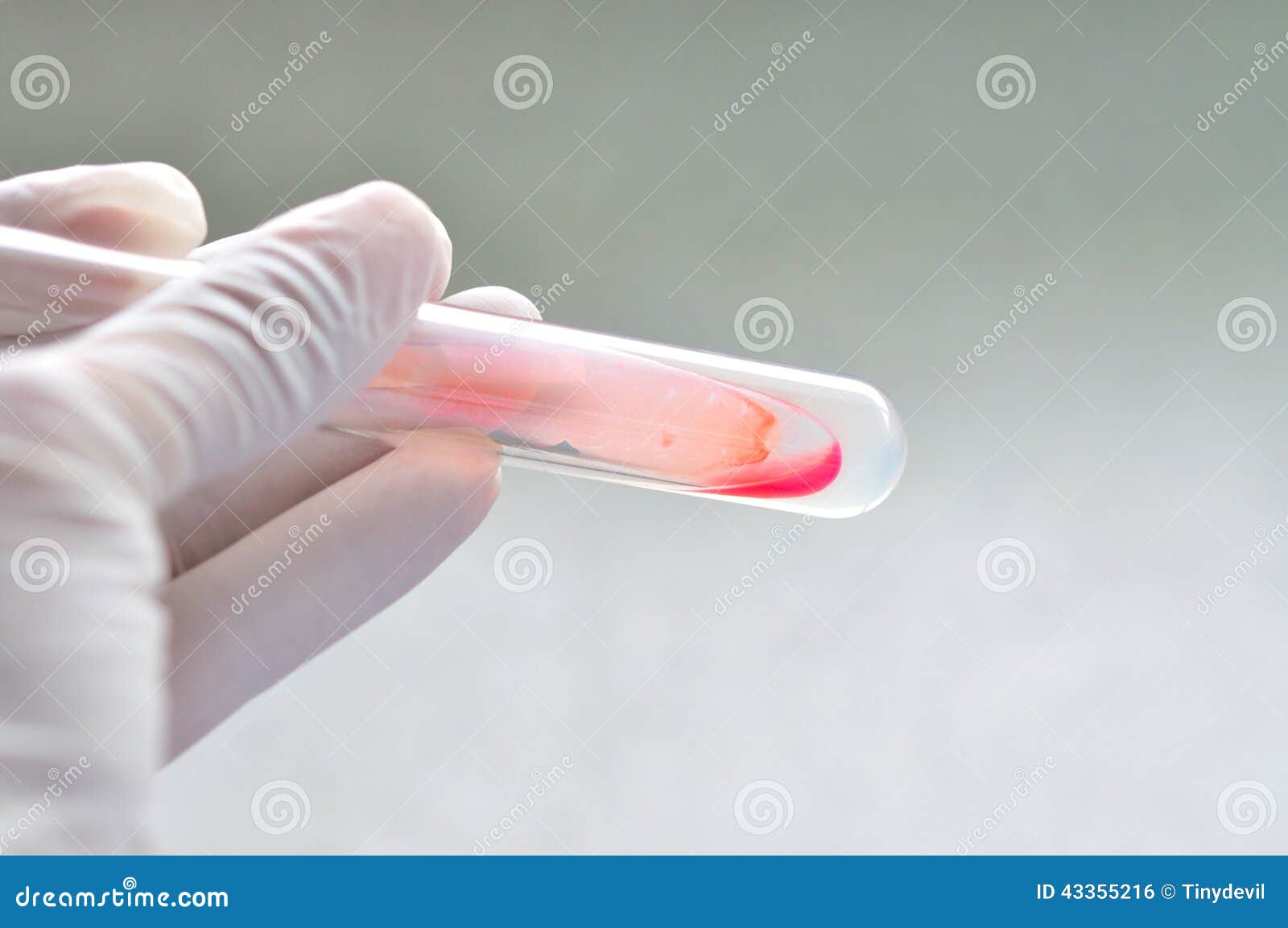 Colony in slant agar stock photo. Image of antibiotic - 43355216