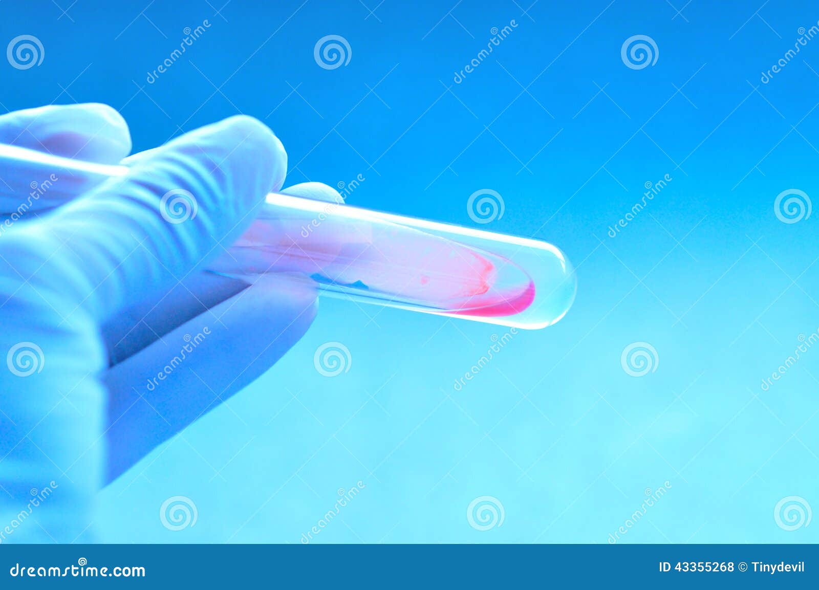 Colony in slant agar stock photo. Image of medicine, culture - 43355268