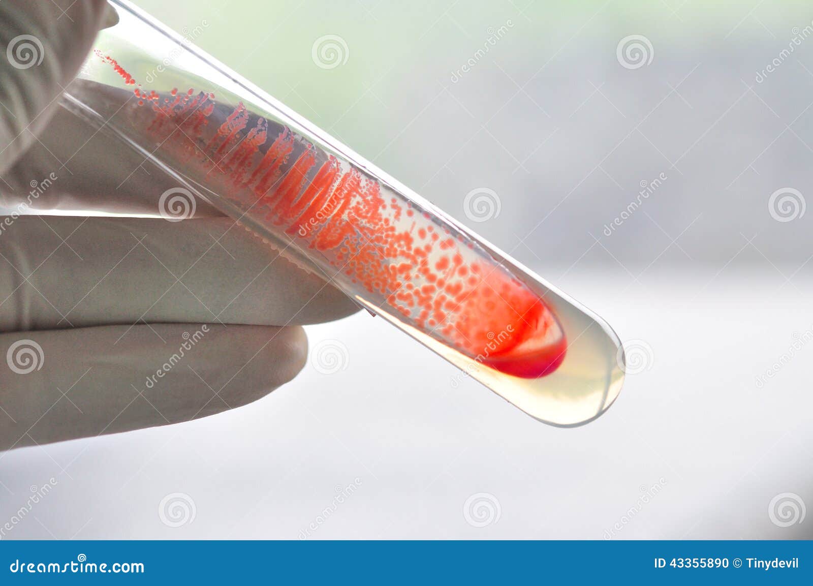 Colony in slant agar stock photo. Image of healthcare - 43355890