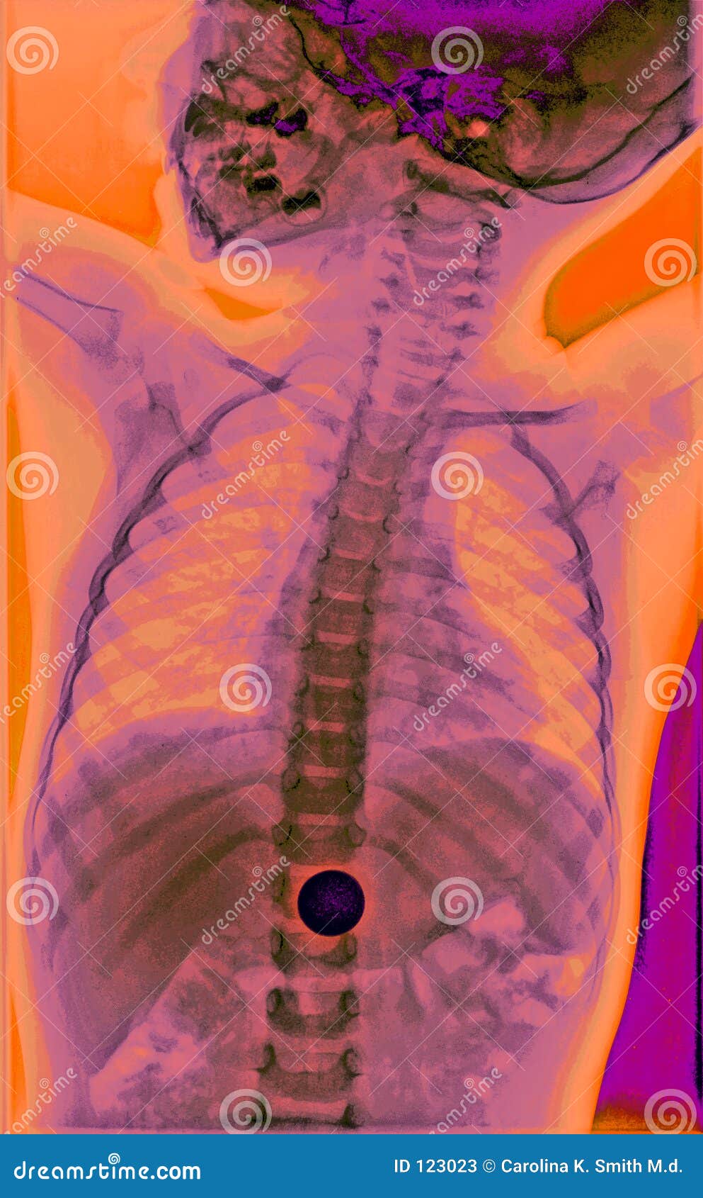 Color X-ray Art, Child 1 stock image. Image of hospital - 123023