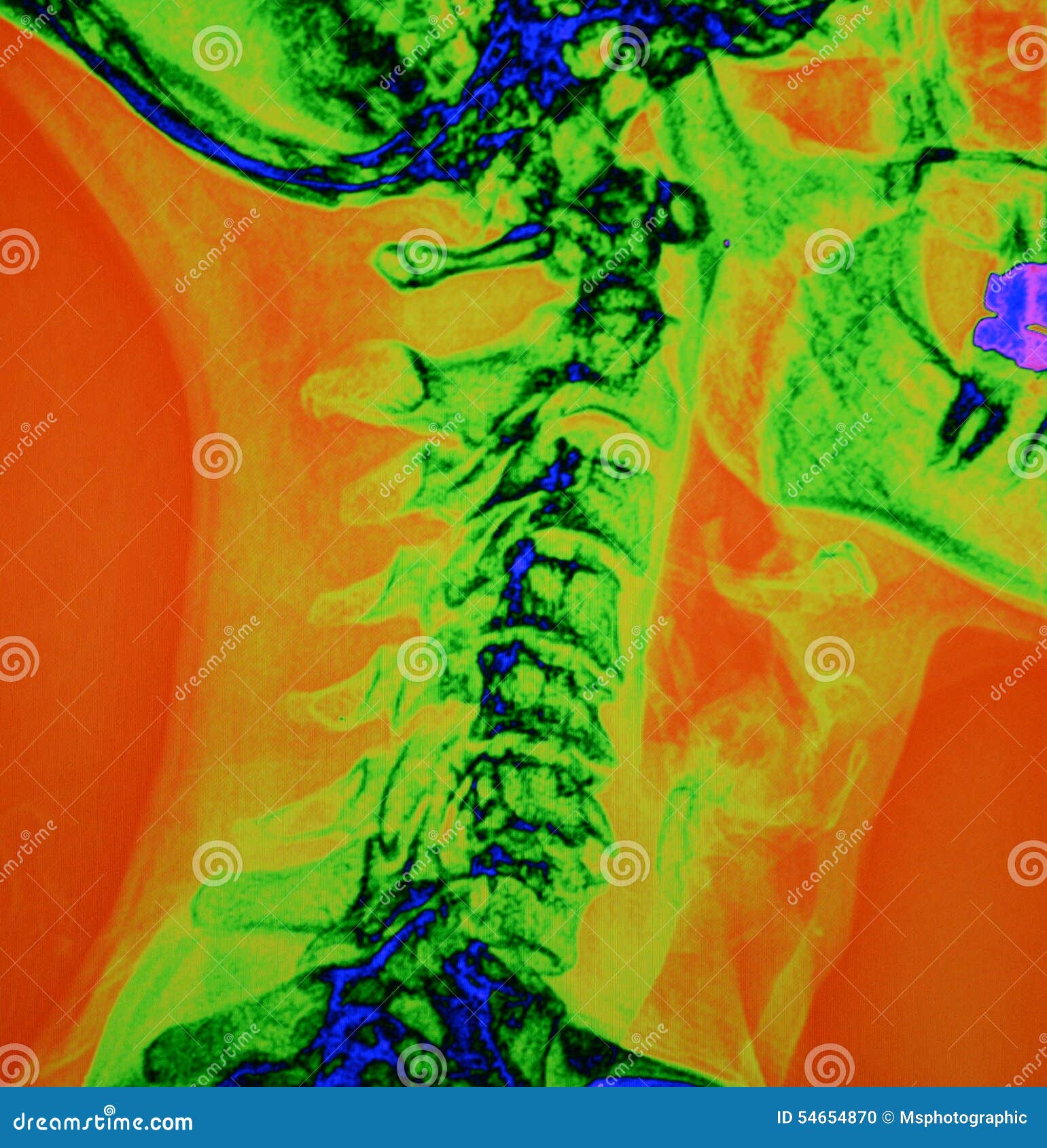 Color spinal X Ray stock photo. Image of medical, human - 54654870