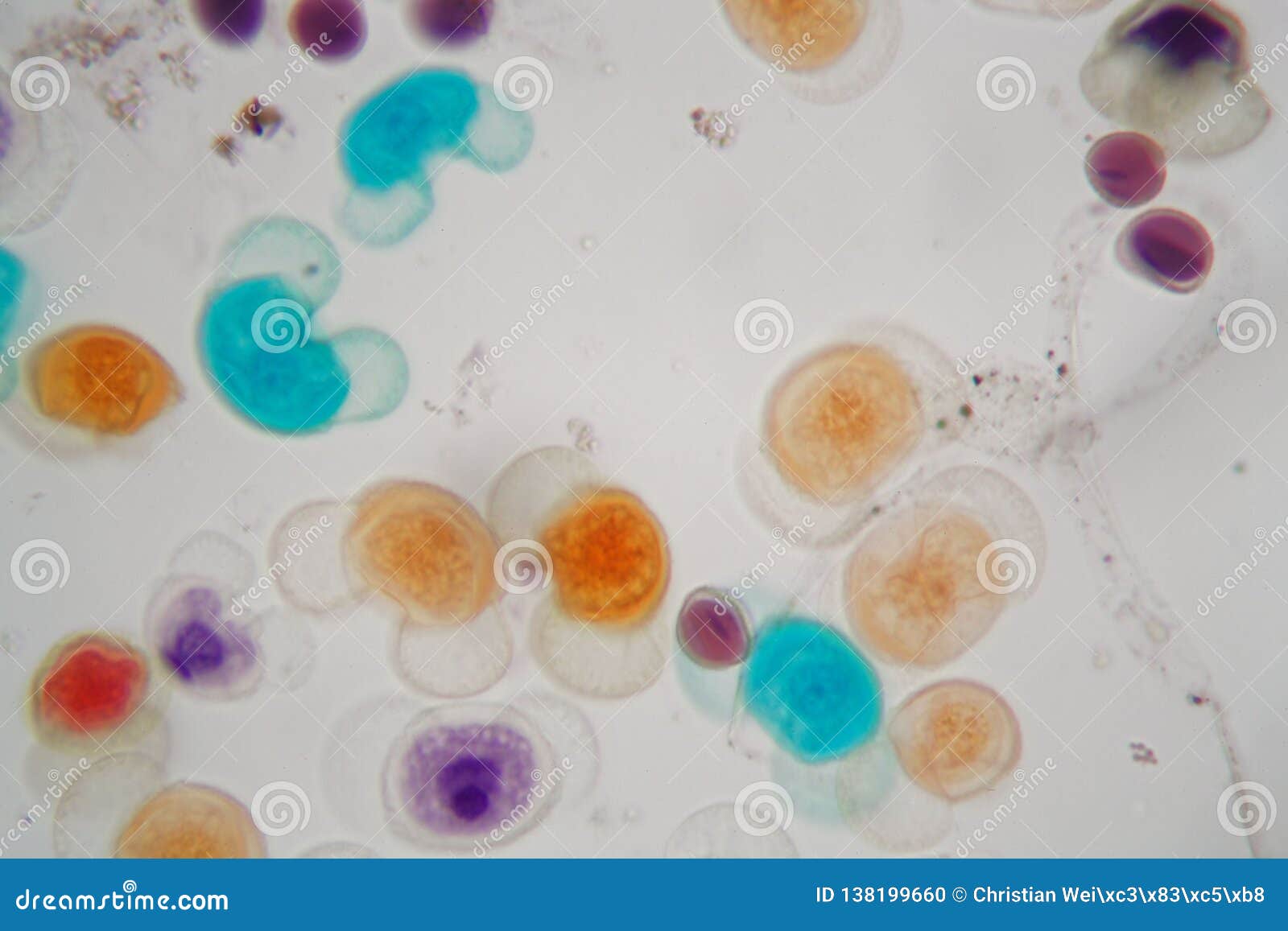Pollen Grains of Different Species Under the Microscope Stock Photo ...