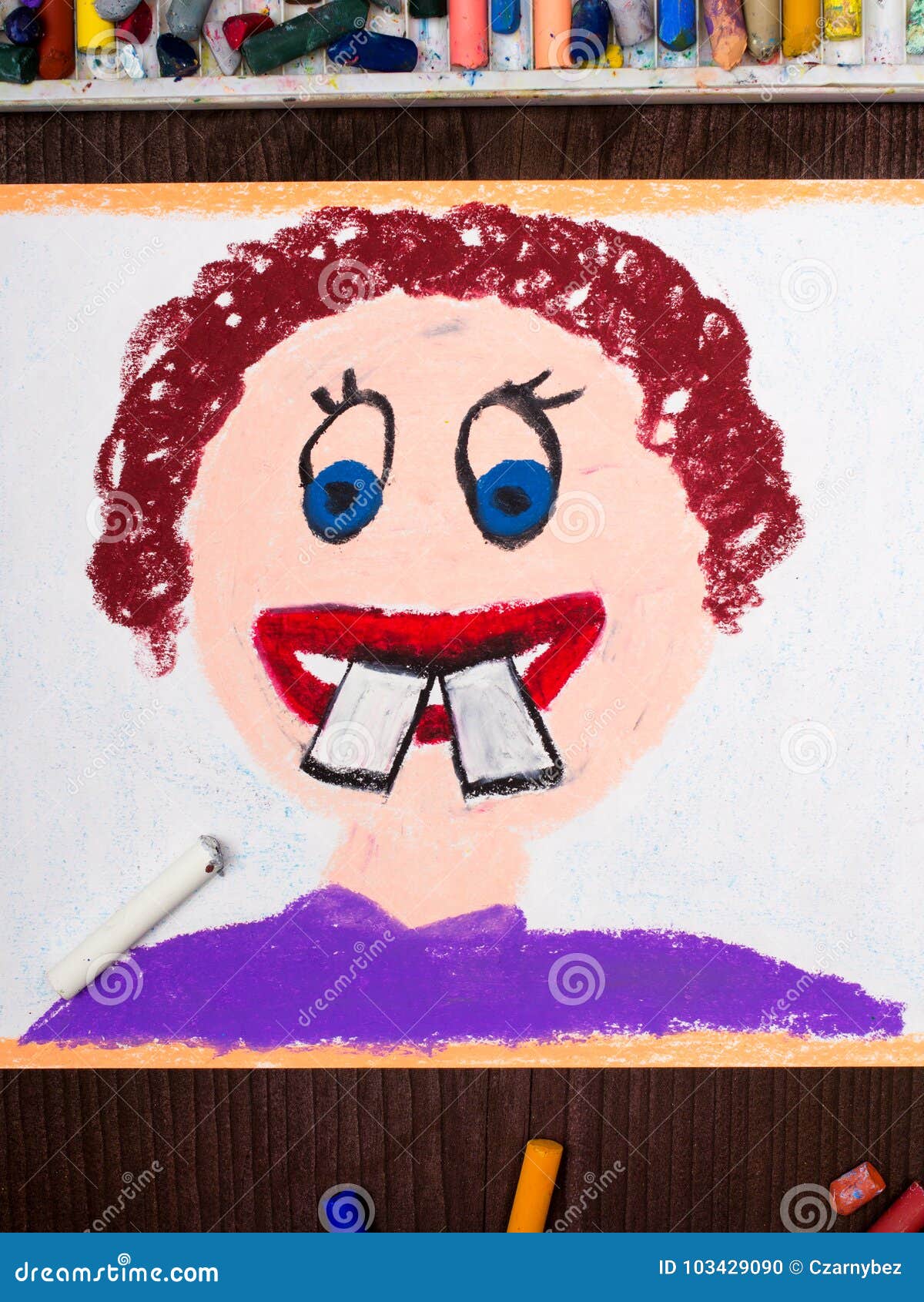 Colorful Drawing: Malocclusion Stock Illustration - Illustration of ...