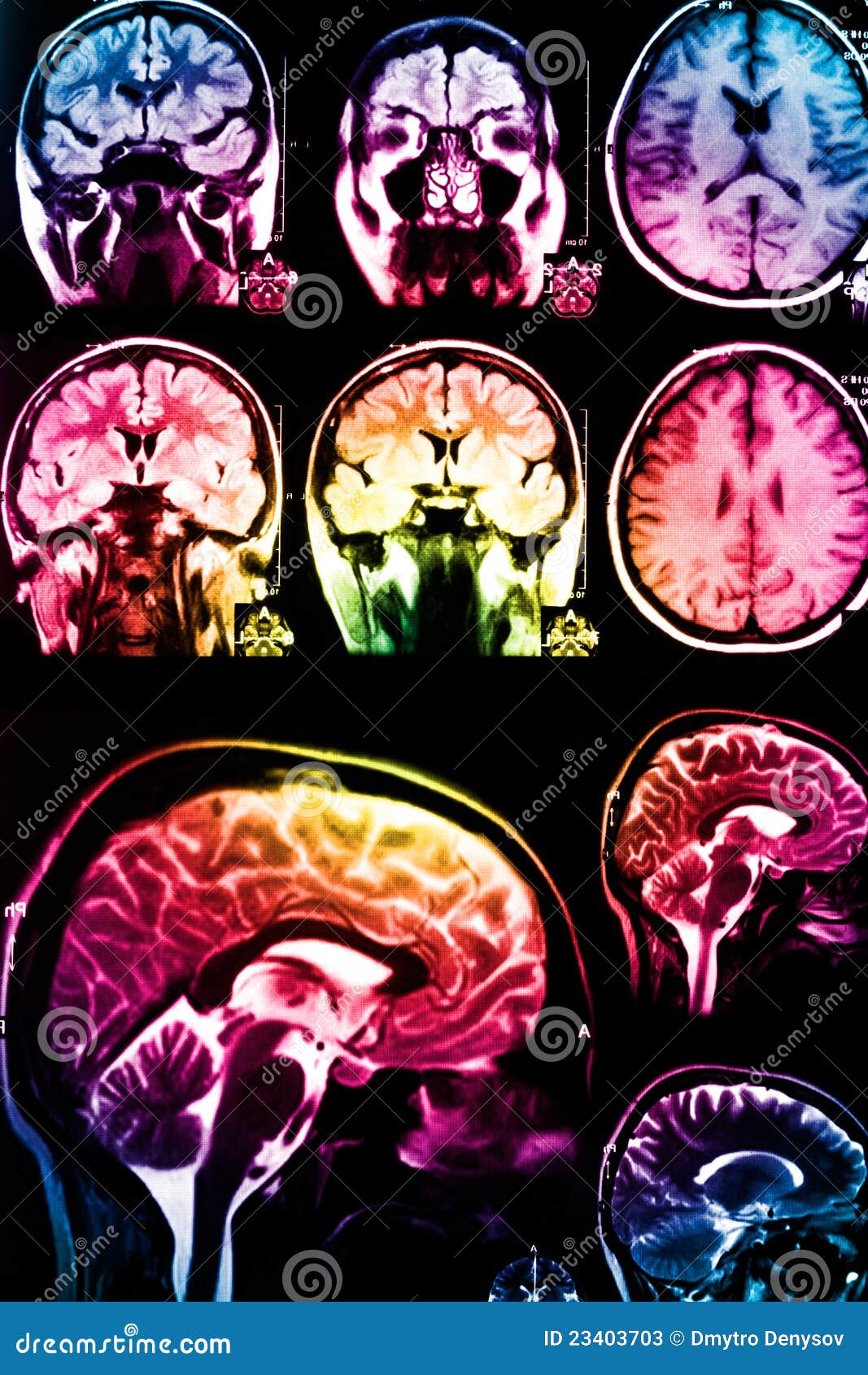 Colorful x-ray scan stock image. Image of cancer, medical - 23403703