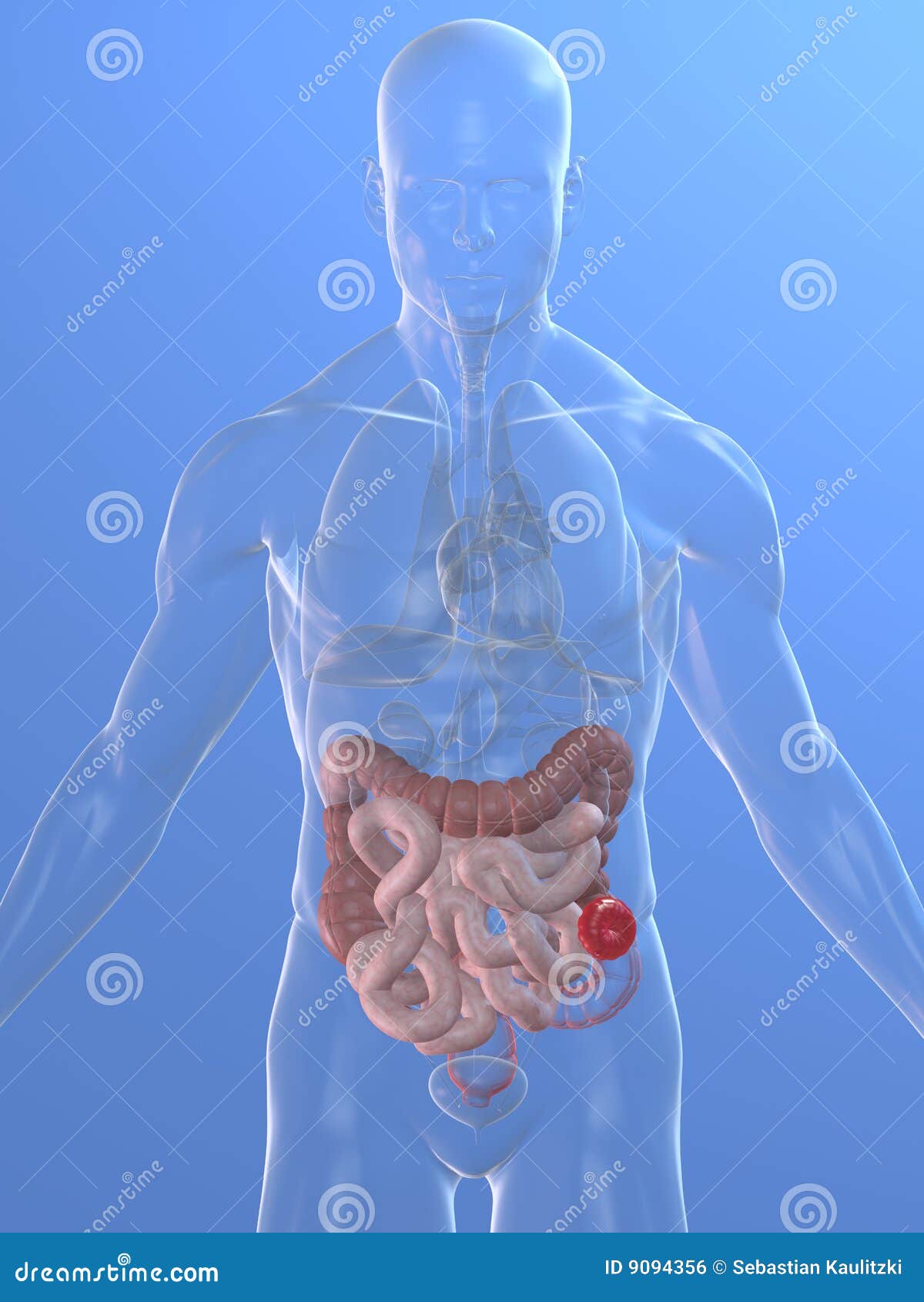 Colostomy Royalty Free Stock Image - Image: 9094356