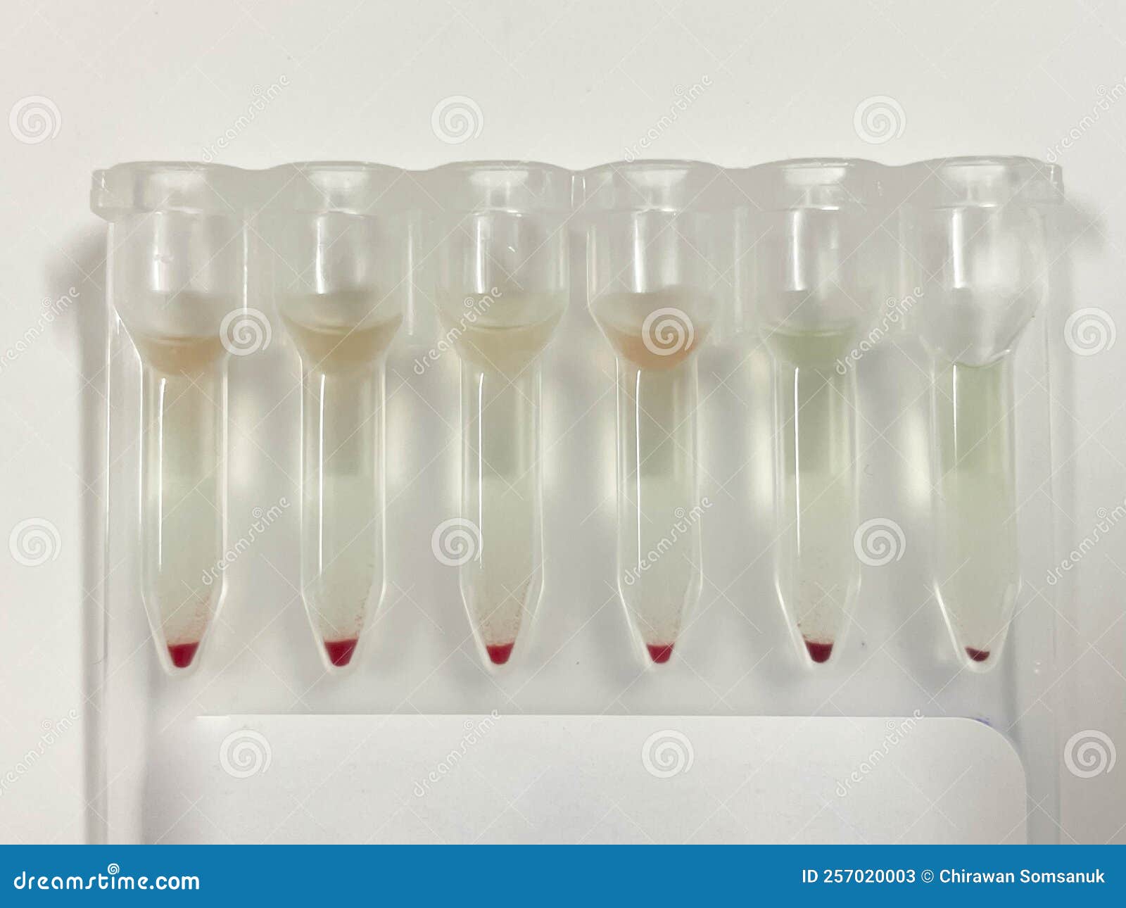 Colume Gel in Crossmatching Testing Stock Image - Image of blood ...