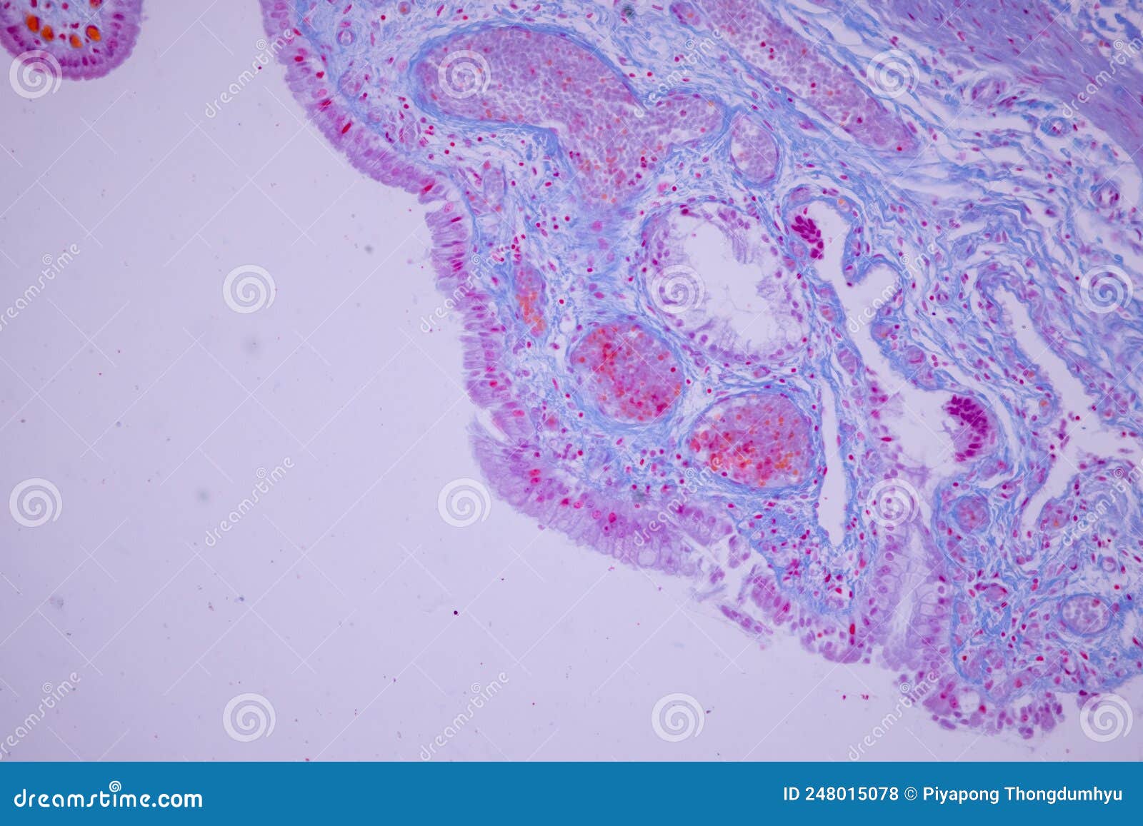 Columnar Epithelium of Human Gall Bladder Under the Microscope in Lab ...