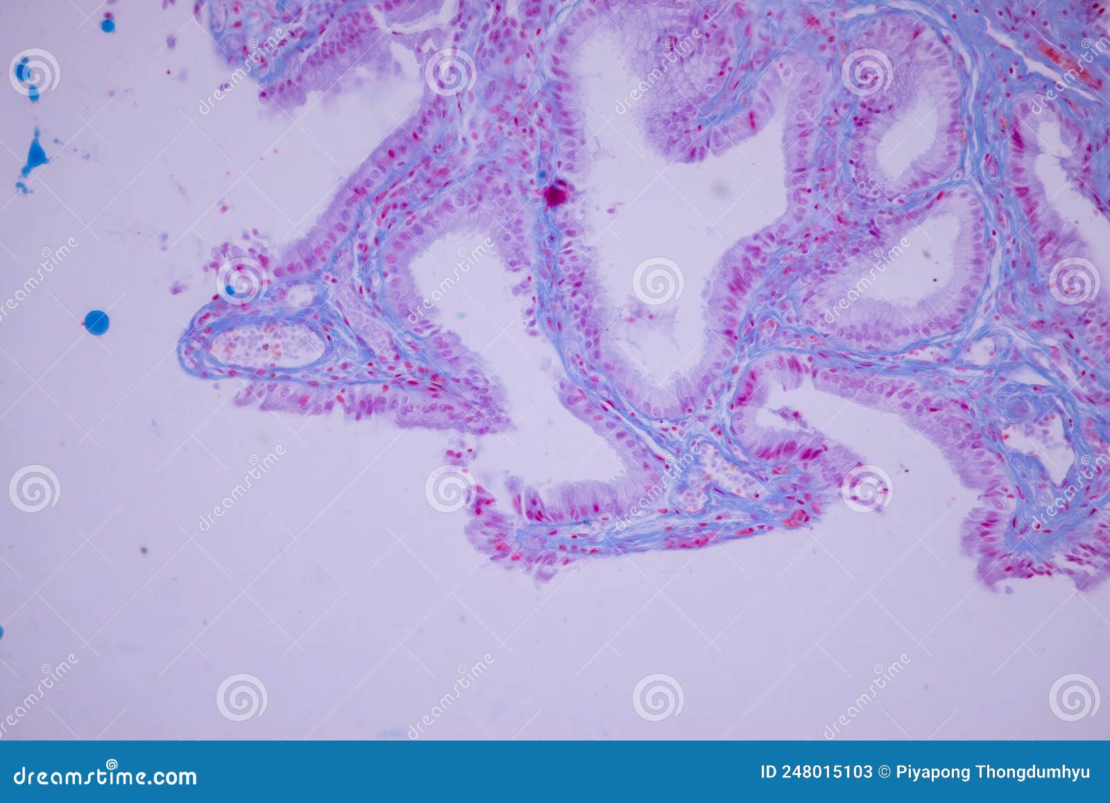 Columnar Epithelium of Human Gall Bladder Under the Microscope in Lab ...