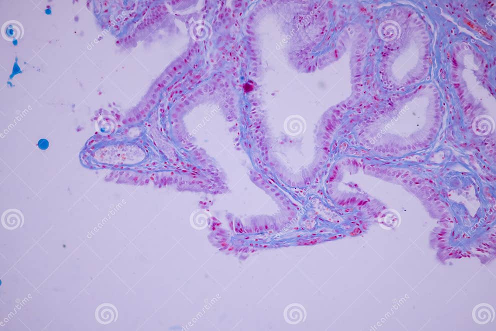 Columnar Epithelium of Human Gall Bladder Under the Microscope in Lab ...