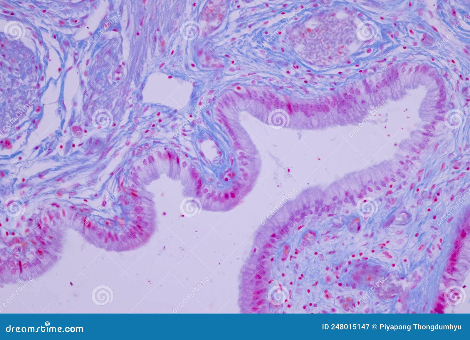 Columnar Epithelium of Human Gall Bladder Under the Microscope in Lab ...
