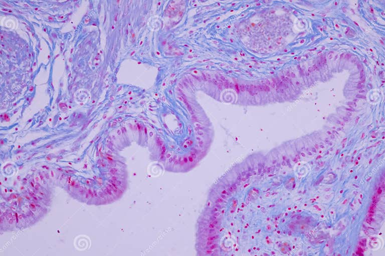 Columnar Epithelium of Human Gall Bladder Under the Microscope in Lab ...