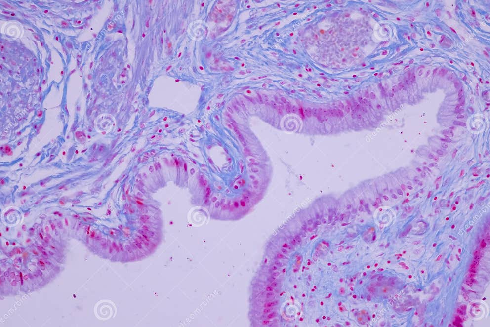 Columnar Epithelium of Human Gall Bladder Under the Microscope in Lab ...