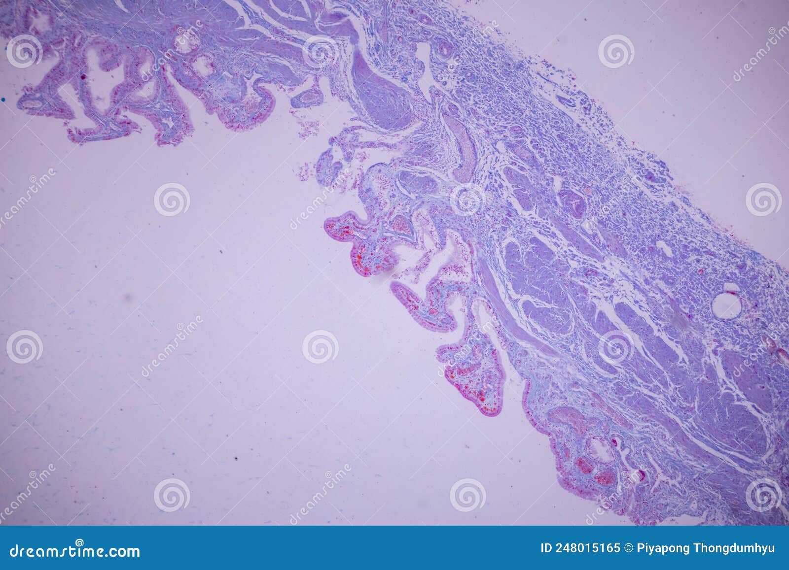 Columnar Epithelium of Human Gall Bladder Under the Microscope in Lab ...