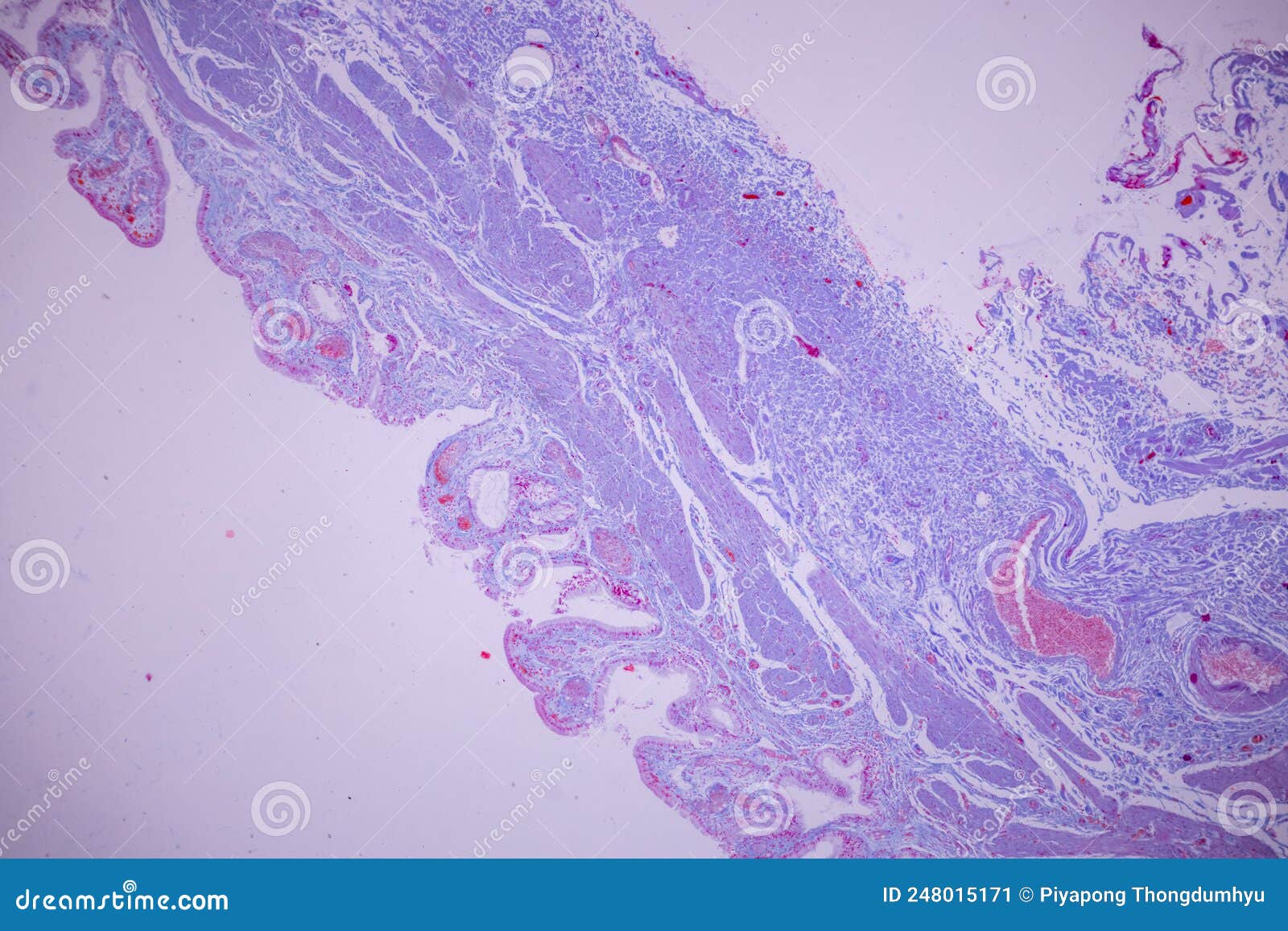 Simple Columnar Epithelium Gallbladder