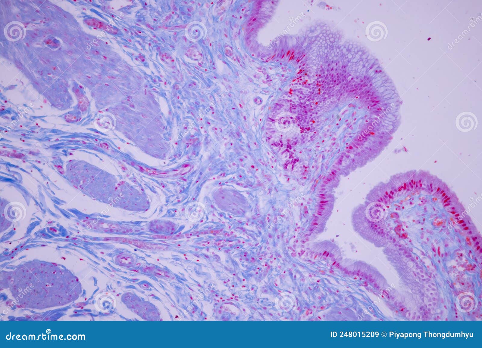 Columnar Epithelium of Human Gall Bladder Under the Microscope in Lab ...