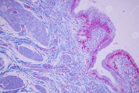 Columnar Epithelium of Human Gall Bladder Under the Microscope in Lab ...