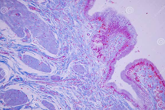 Columnar Epithelium of Human Gall Bladder Under the Microscope in Lab ...