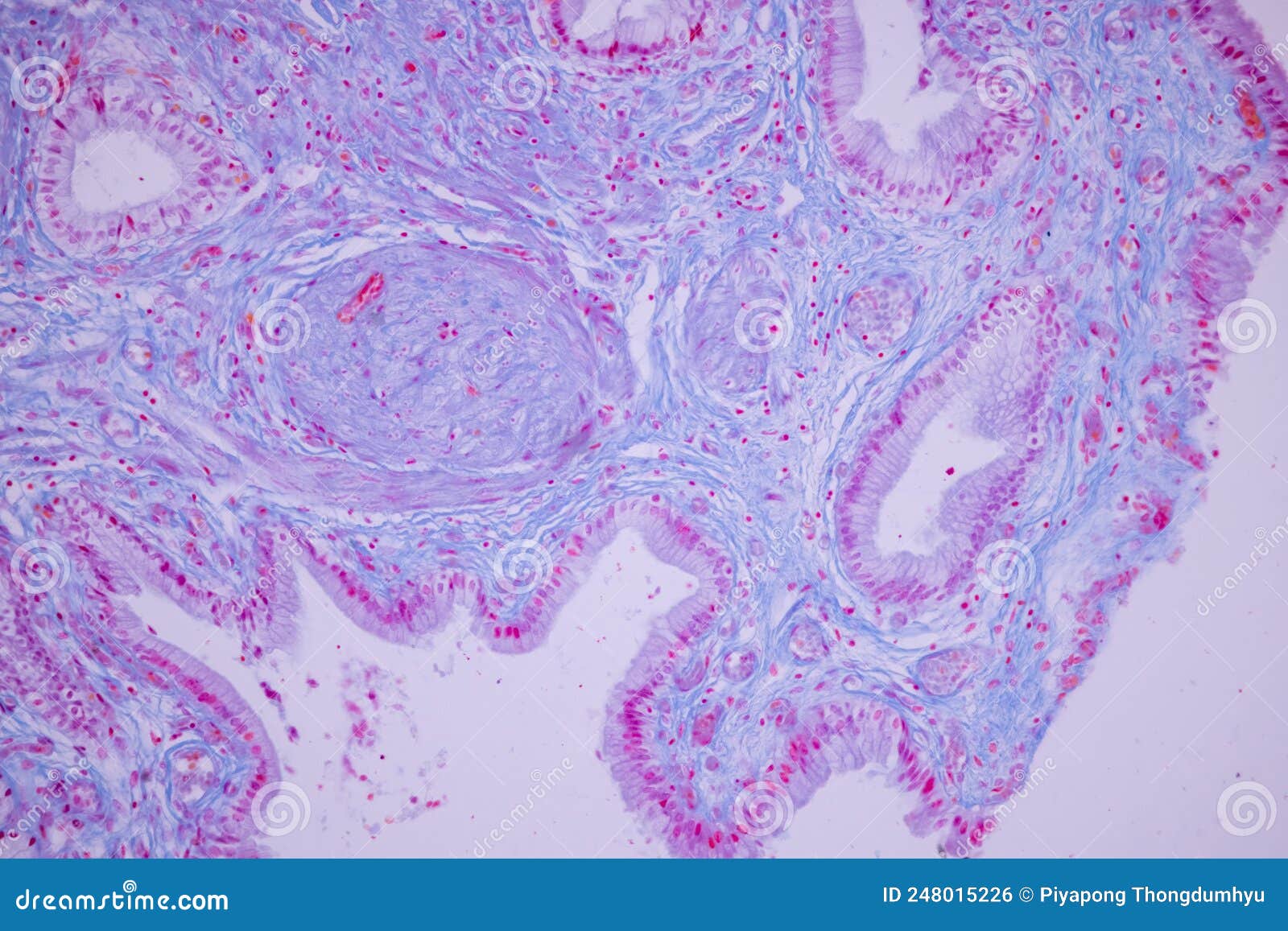 Columnar Epithelium of Human Gall Bladder Under the Microscope in Lab ...
