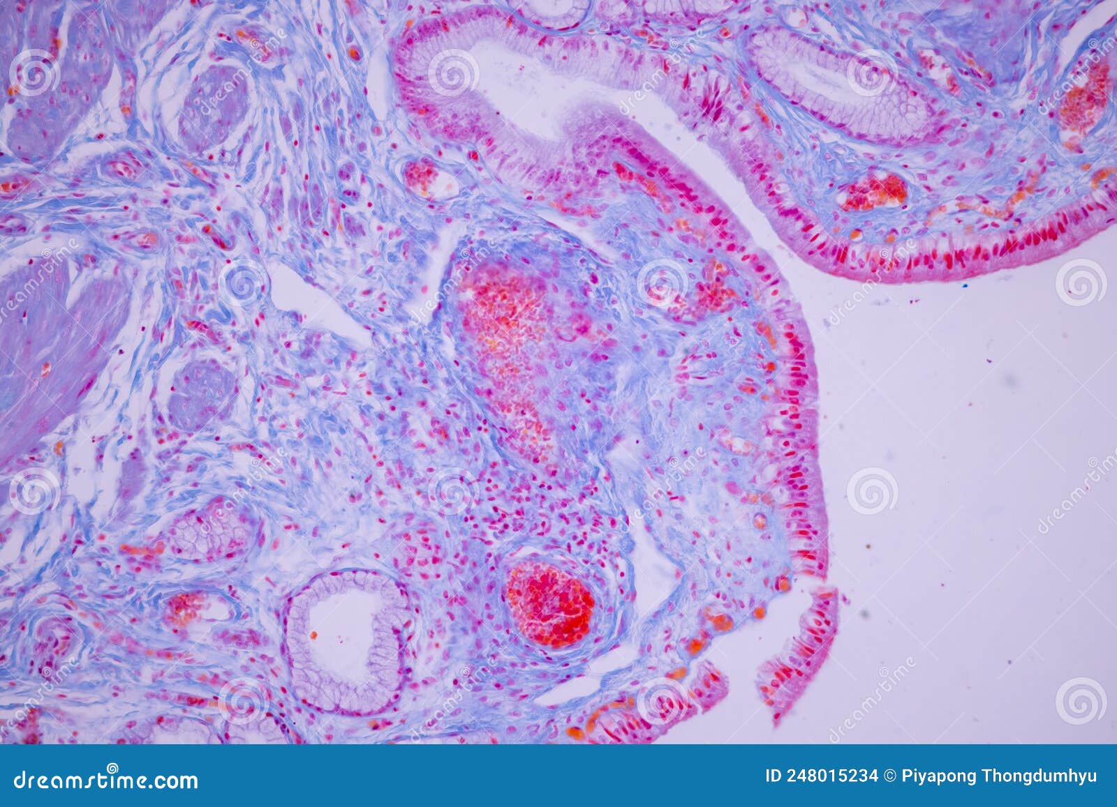 Columnar Epithelium of Human Gall Bladder Under the Microscope in Lab ...
