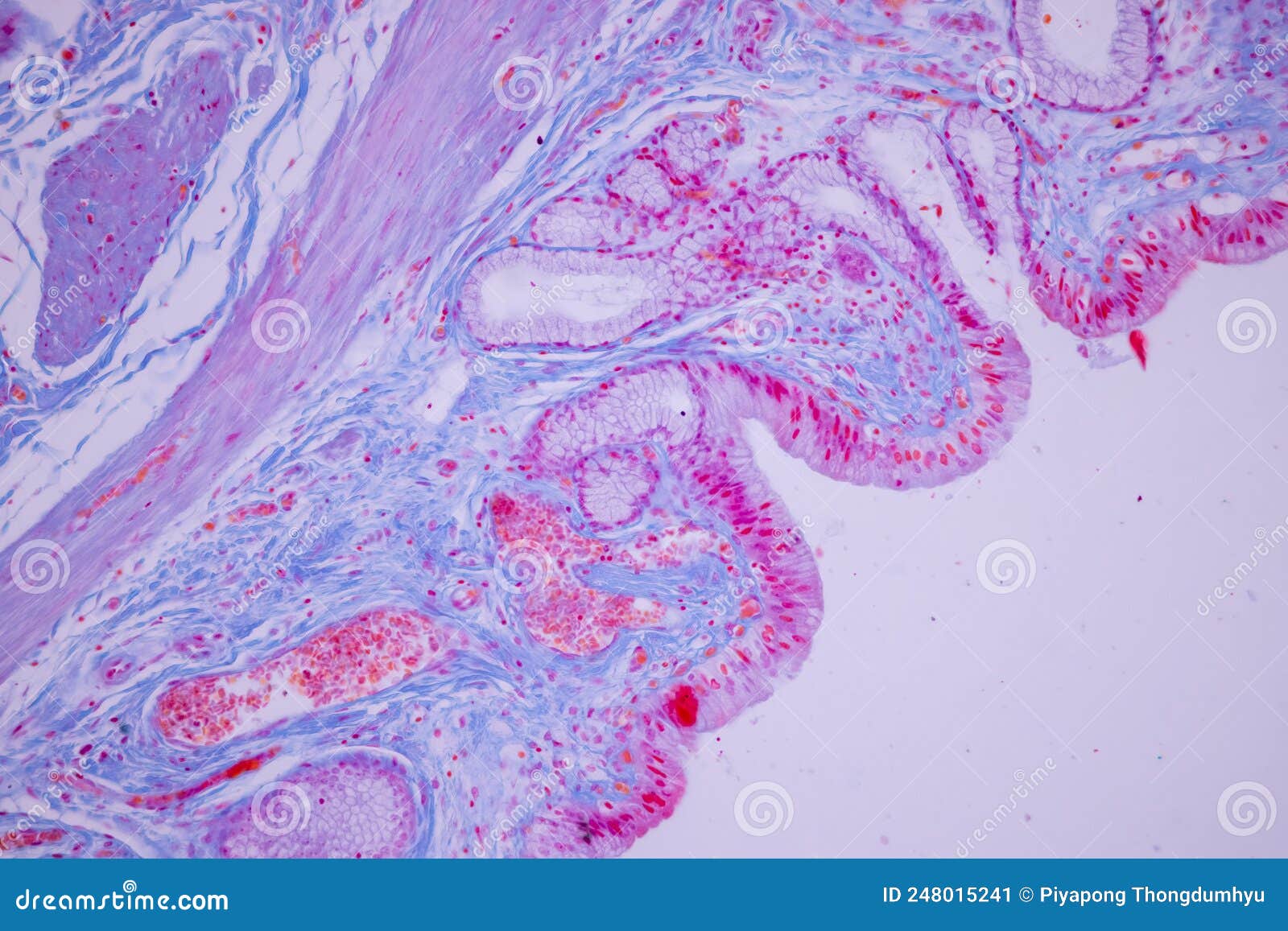 Columnar Epithelium of Human Gall Bladder Under the Microscope in Lab ...