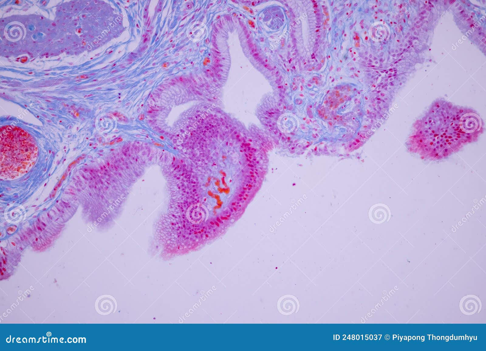 Columnar Epithelium of Human Gall Bladder Under the Microscope in Lab ...