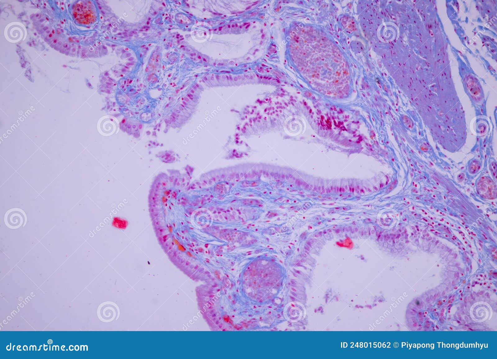 Columnar Epithelium of Human Gall Bladder Under the Microscope in Lab ...