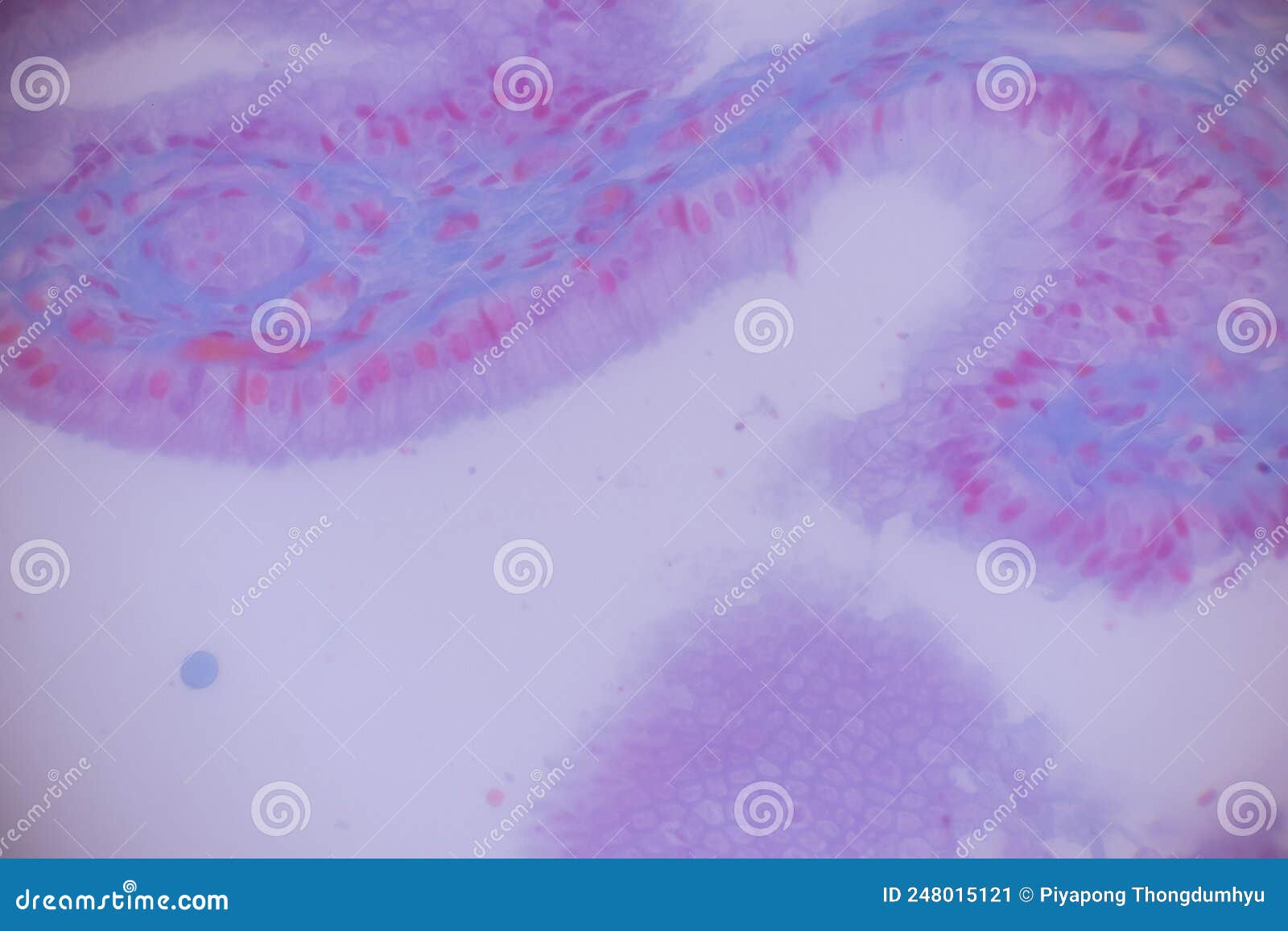Columnar Epithelium of Human Gall Bladder Under the Microscope in Lab ...