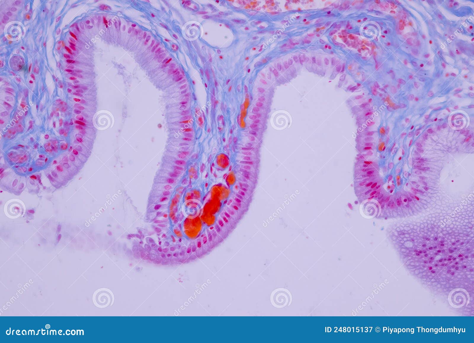 Columnar Epithelium of Human Gall Bladder Under the Microscope in Lab ...