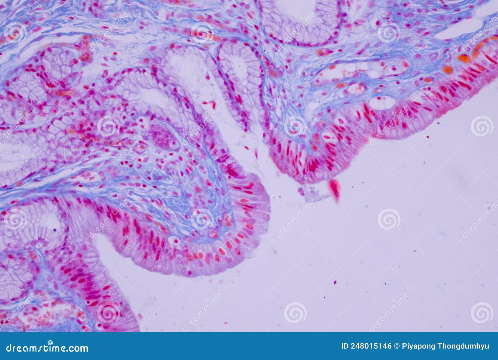 Columnar Epithelium of Human Gall Bladder Under the Microscope in Lab ...