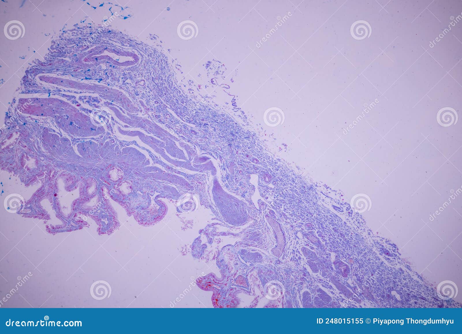 Columnar Epithelium of Human Gall Bladder Under the Microscope in Lab ...