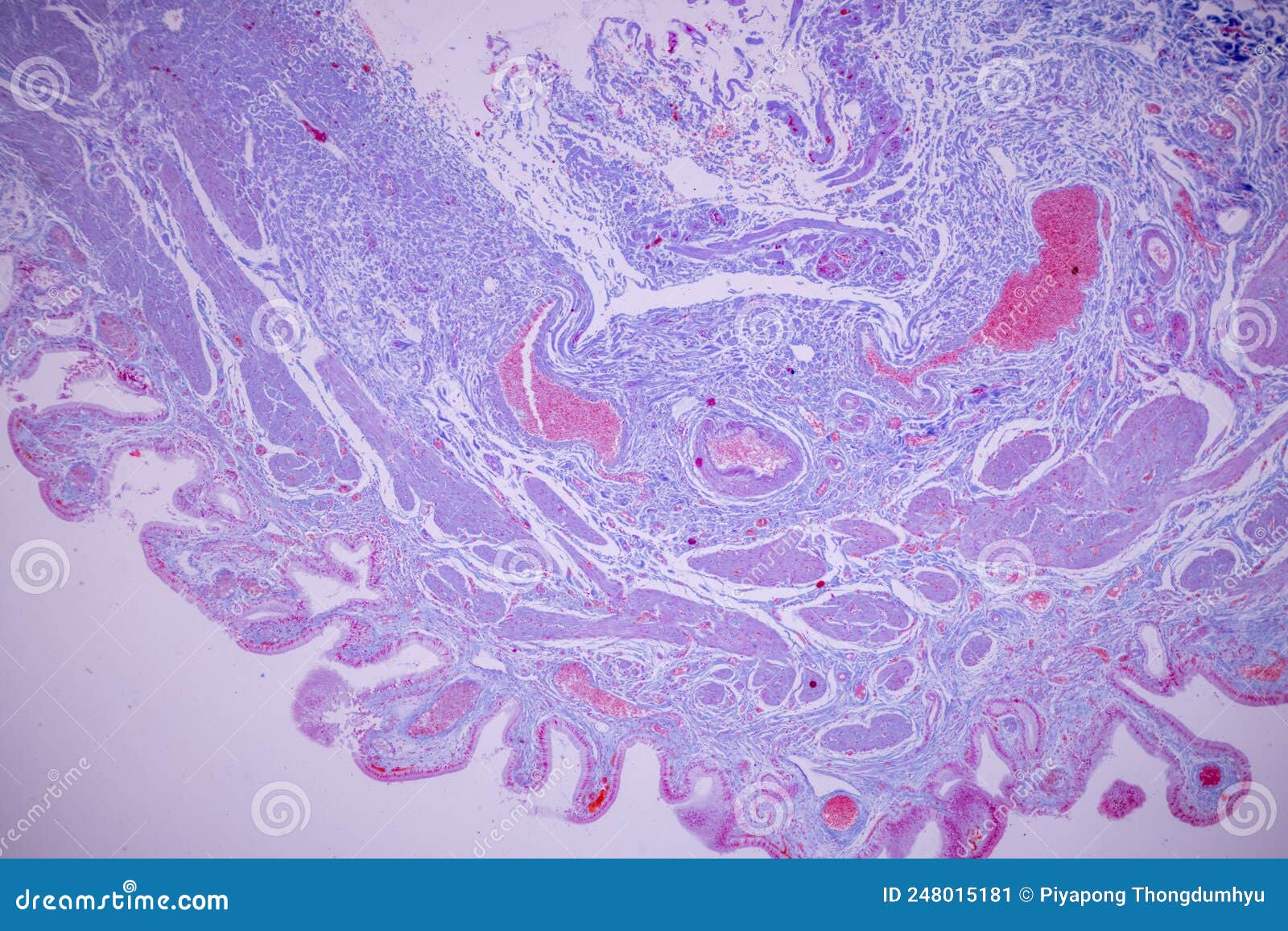 Columnar Epithelium of Human Gall Bladder Under the Microscope in Lab ...