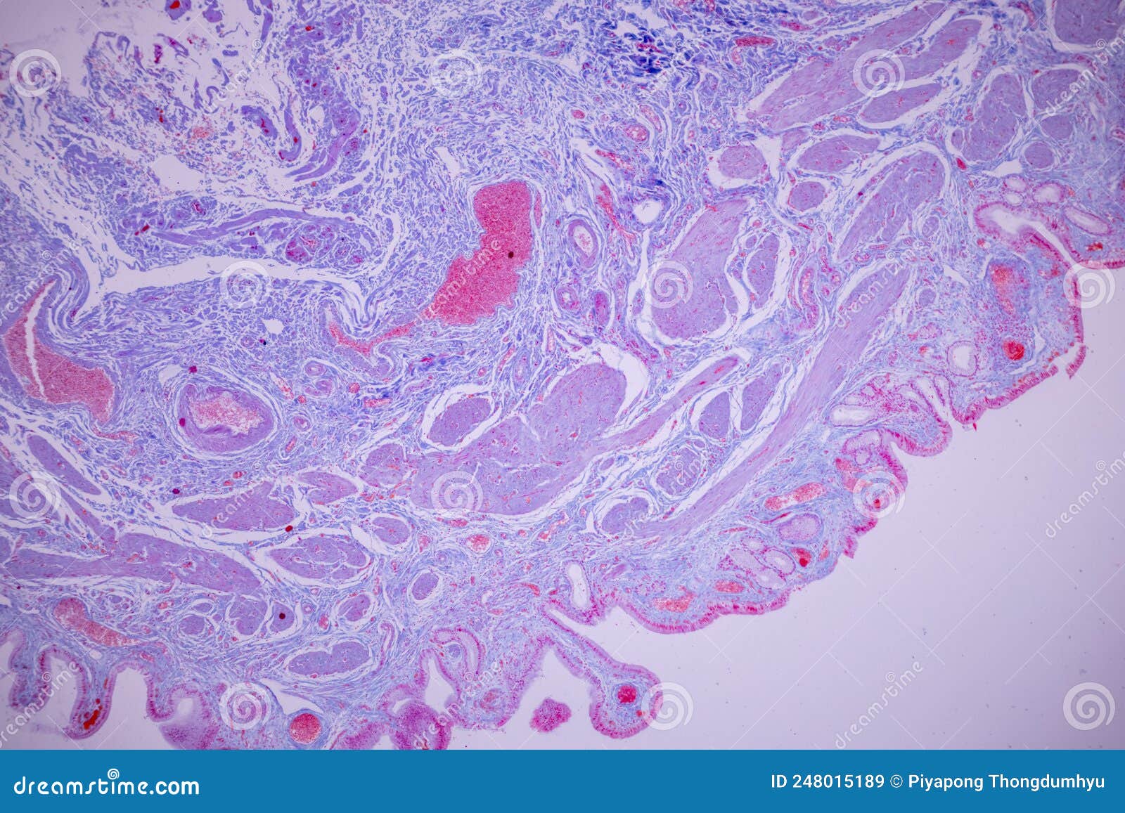 A Closeup Of Pseudostratified Ciliated Columnar Epithelium Displaying ...