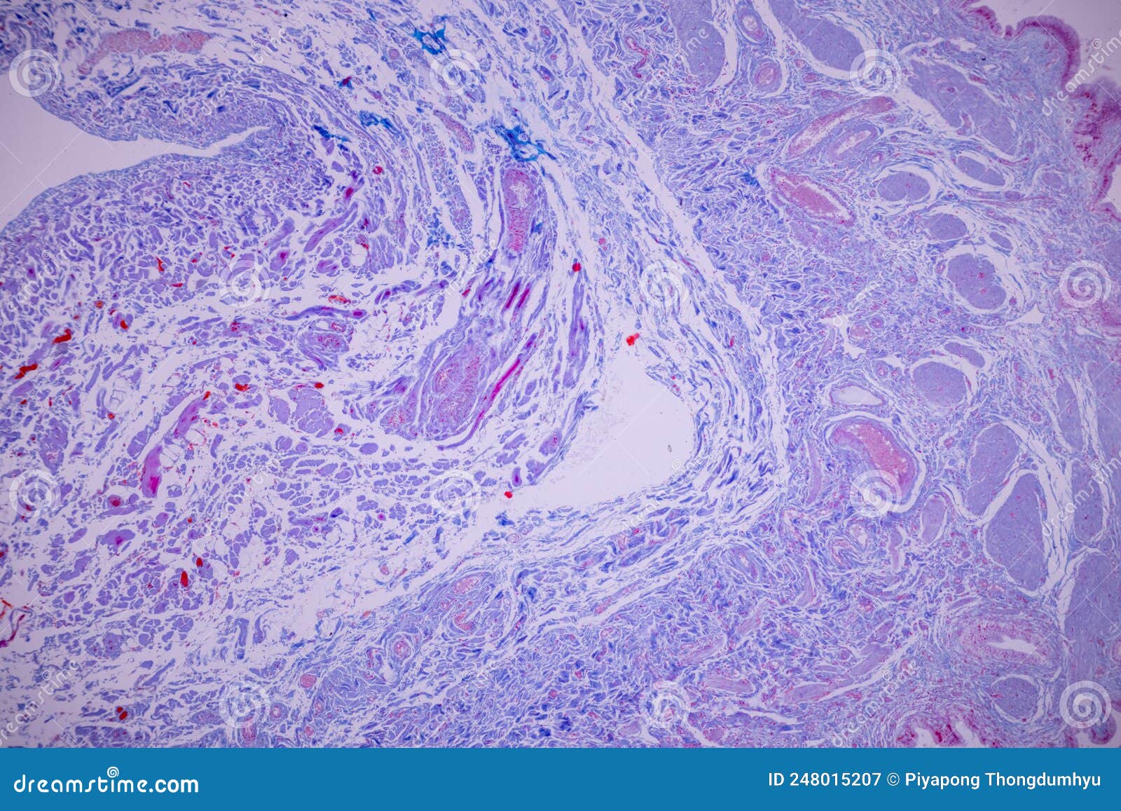 Columnar Epithelium of Human Gall Bladder Under the Microscope in Lab ...