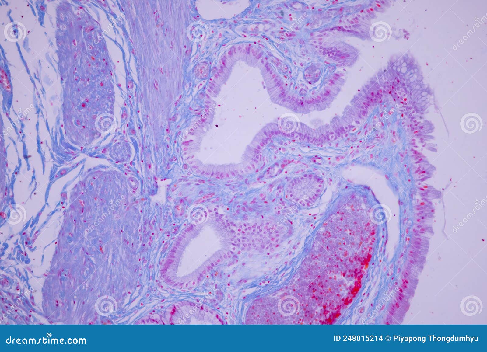 Columnar Epithelium of Human Gall Bladder Under the Microscope in Lab ...