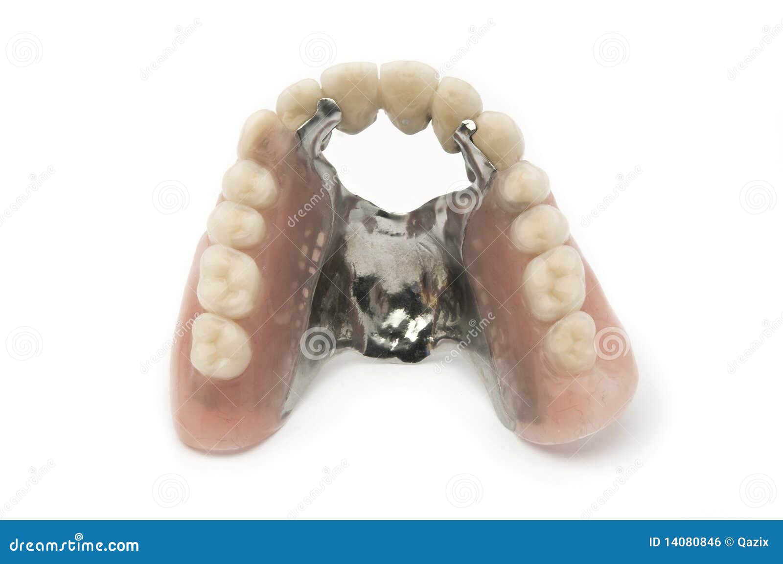 Combined Fixed and Mobile Prosthesis Stock Photo - Image of precision ...