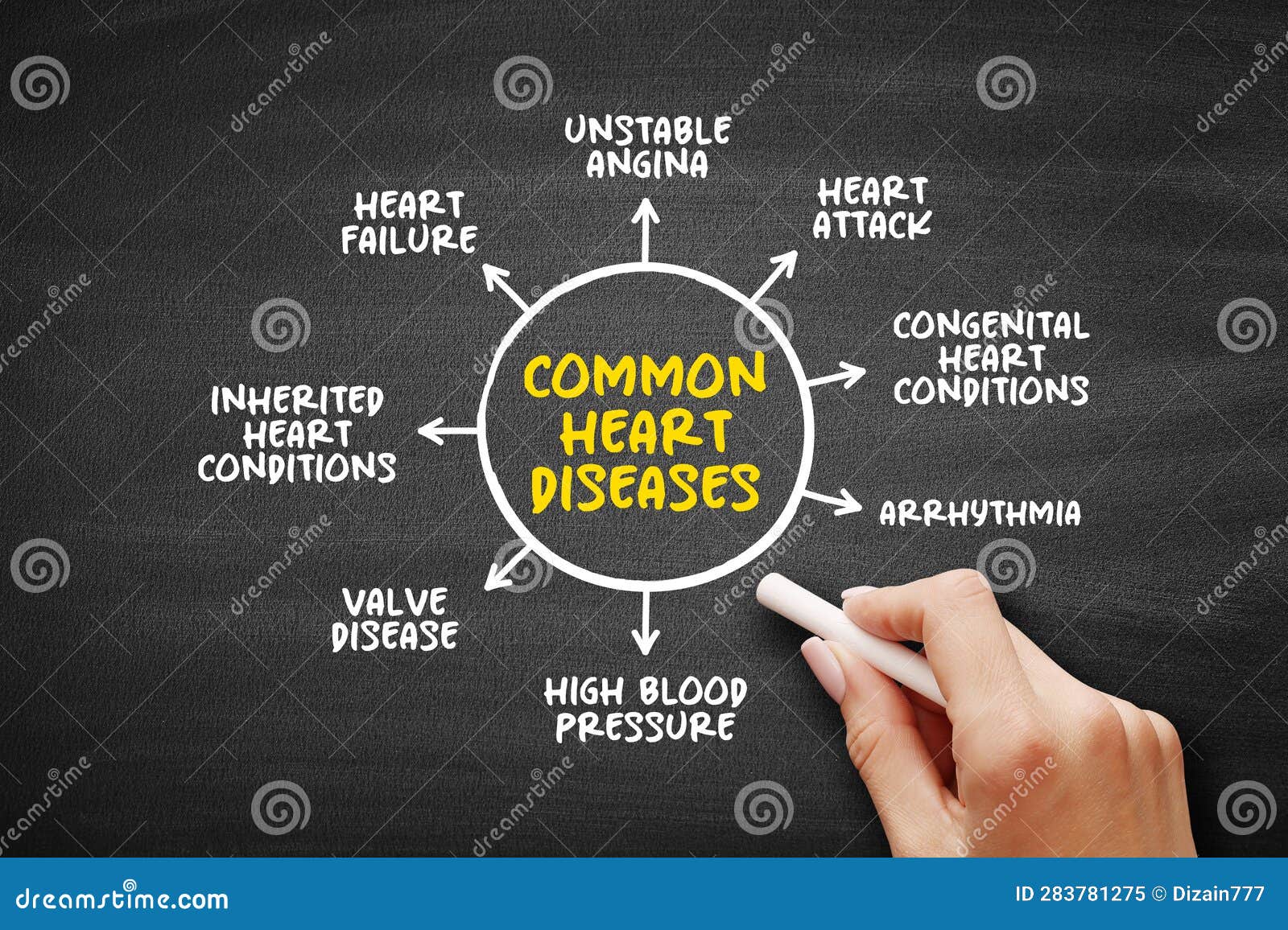 Common Heart Diseases Mind Map Text Concept for Presentations and ...