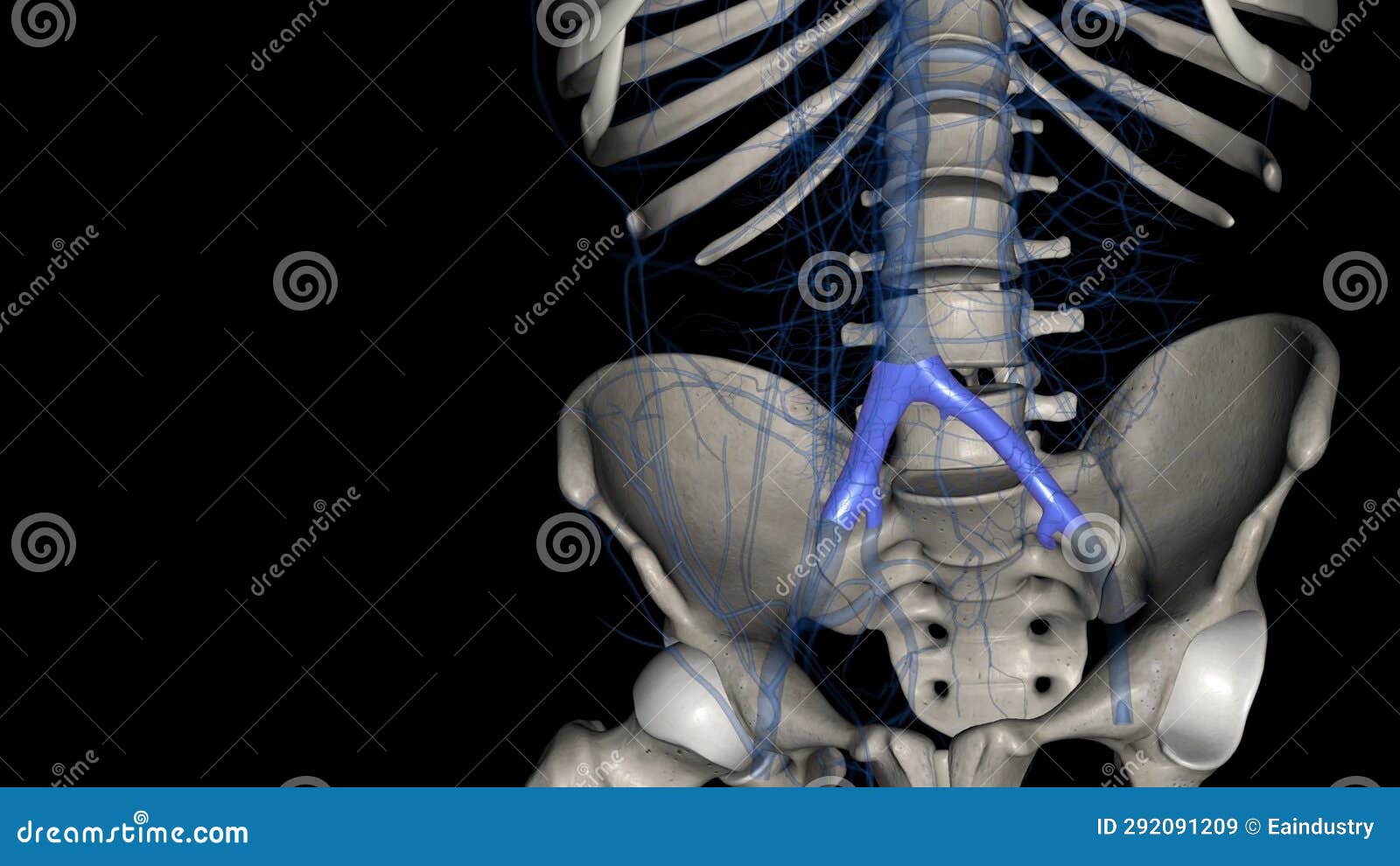 The Common Iliac Vein is Formed by the Unification of the Internal and ...